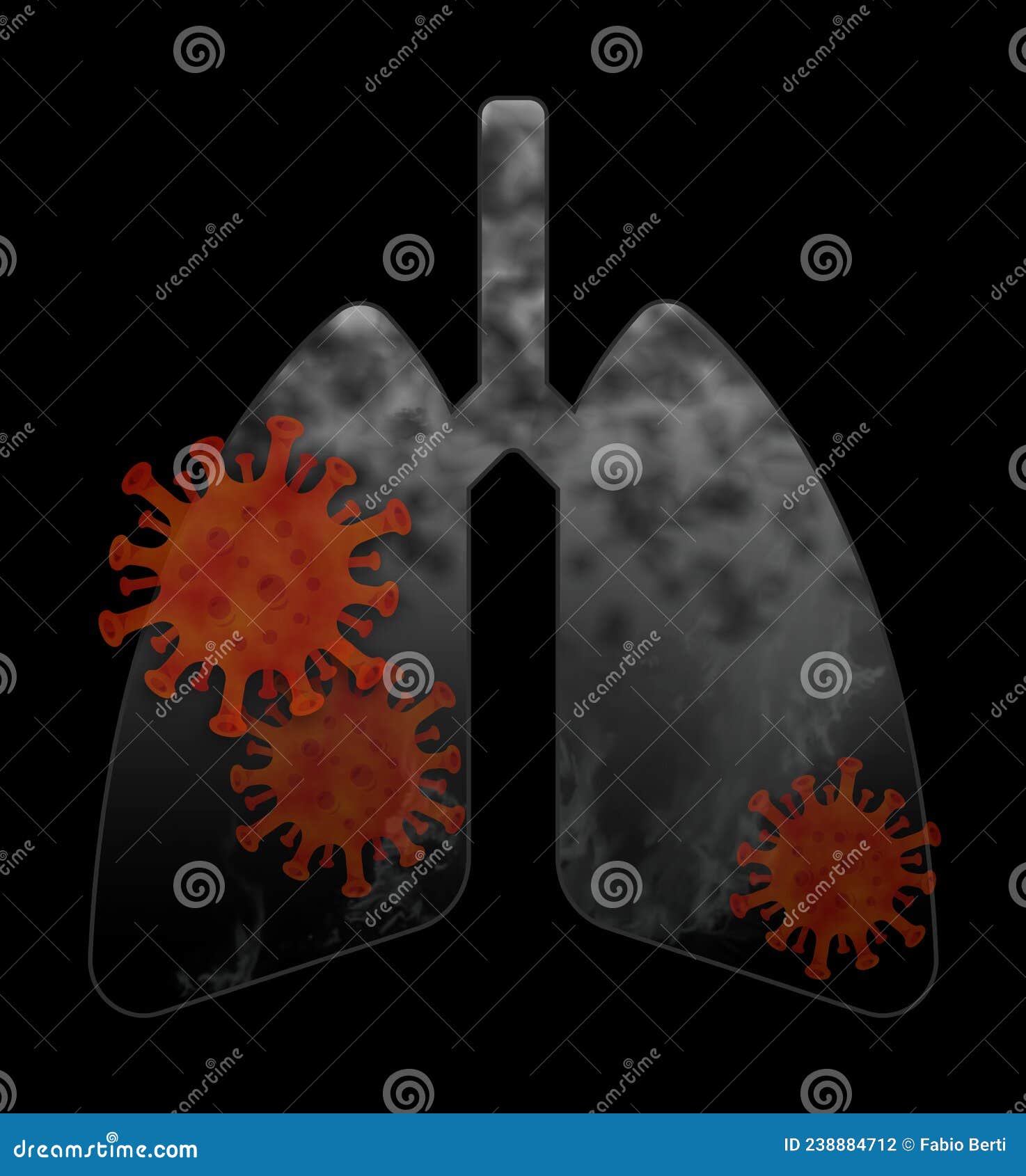 X Ray of Lungs with Red Virus Inside Stock Illustration - Illustration ...