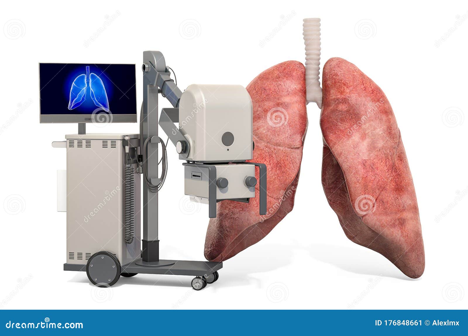 X-ray Machine with Human Lungs, 3D Rendering Stock Illustration ...