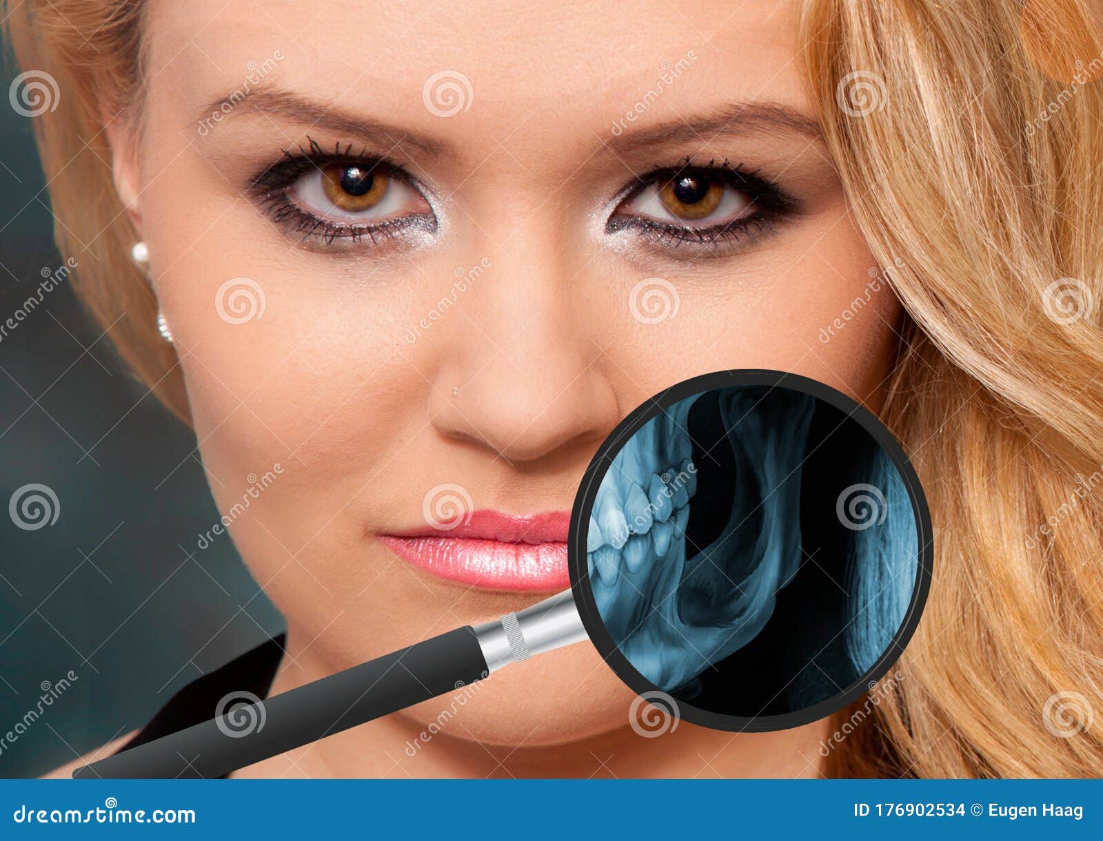 X-ray with a Magnifying Glass from the Visual Field of a Person`s Jaw ...