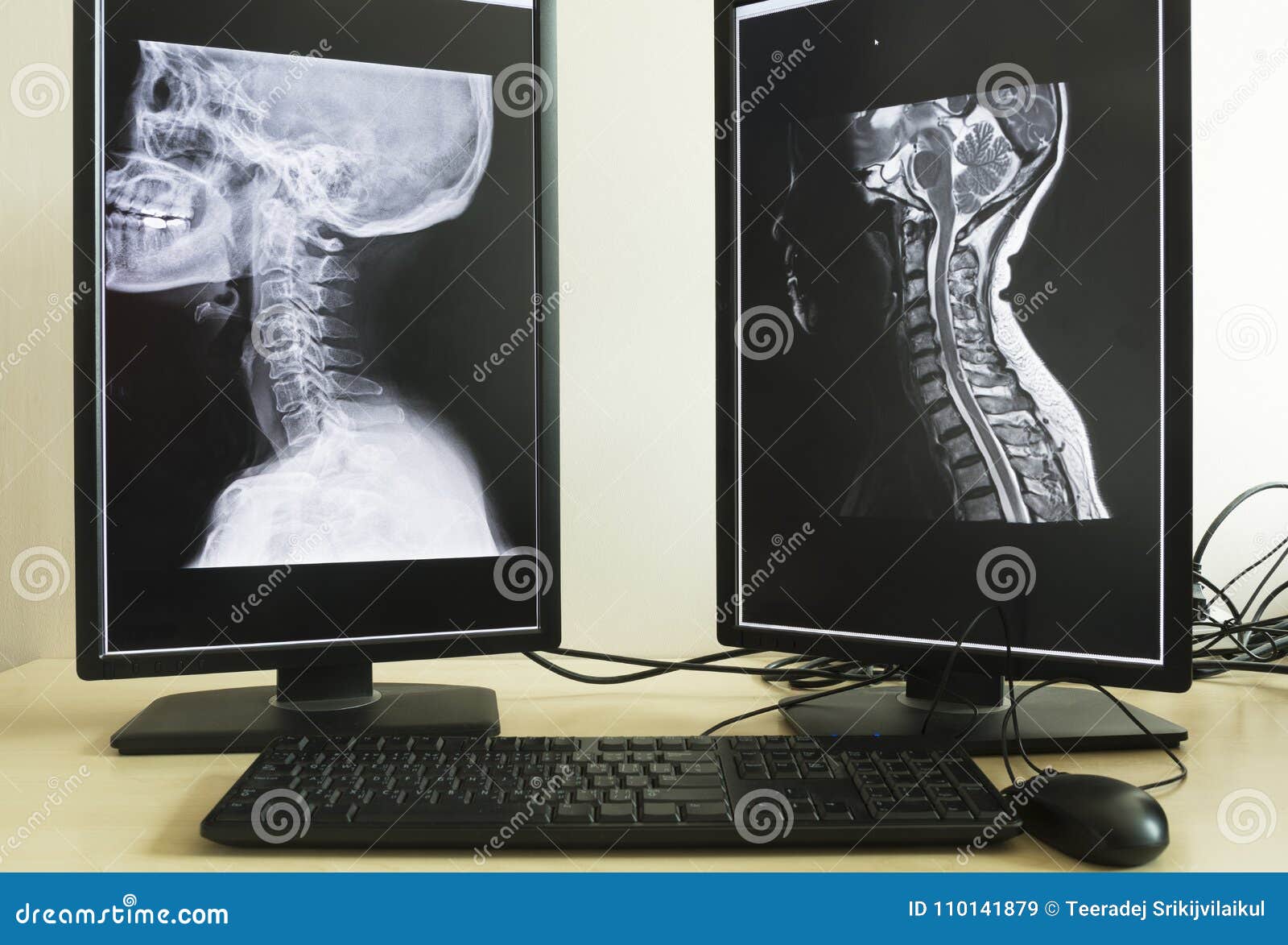 X-ray and MRI of Neck in Doctor Office Stock Image - Image of ...