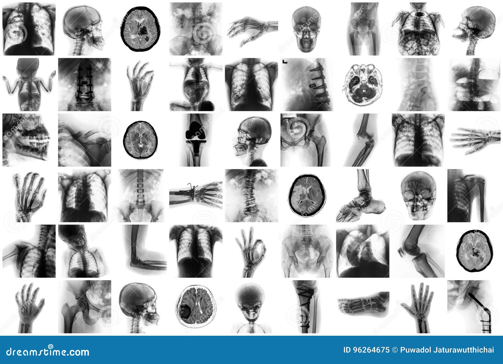 Set Of X-ray Multiple Part Of Human . Skeletal System . Royalty-Free ...