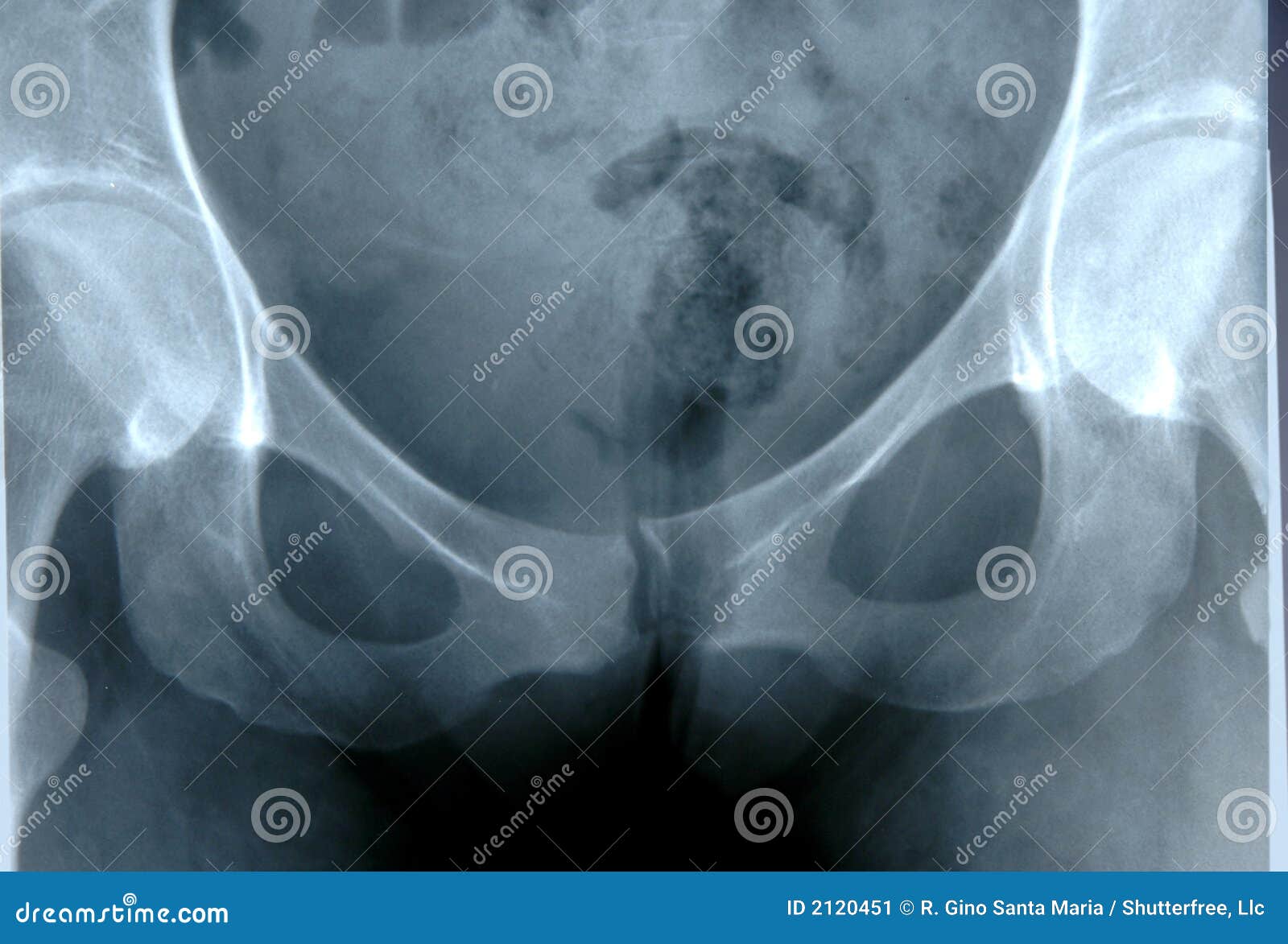 Radiogram Of Abdominal Cavity And Thoracic Cavity Cat Royalty-Free ...