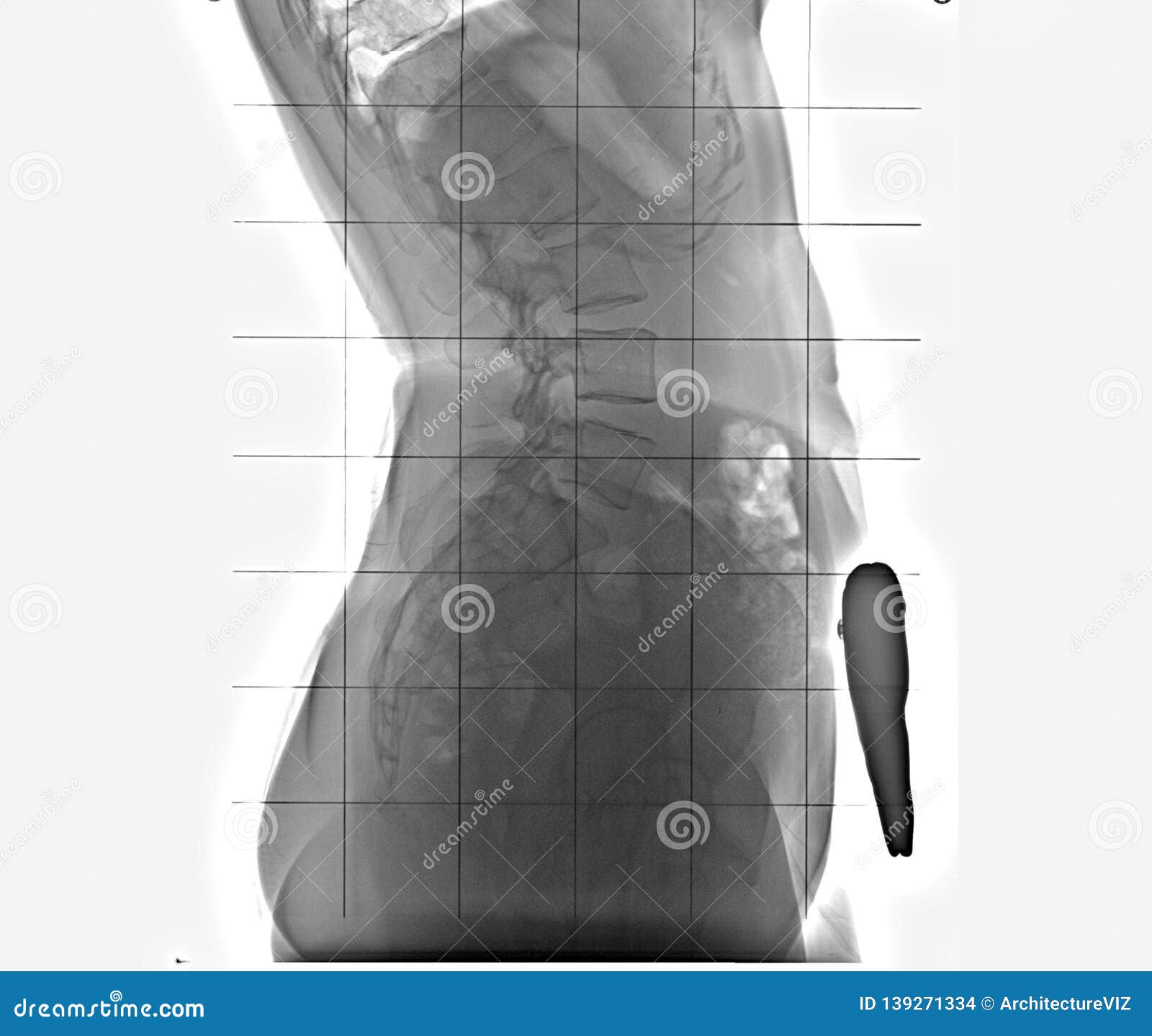 X-ray of the Pelvis and Spinal Column, Side View Stock Photo - Image of ...