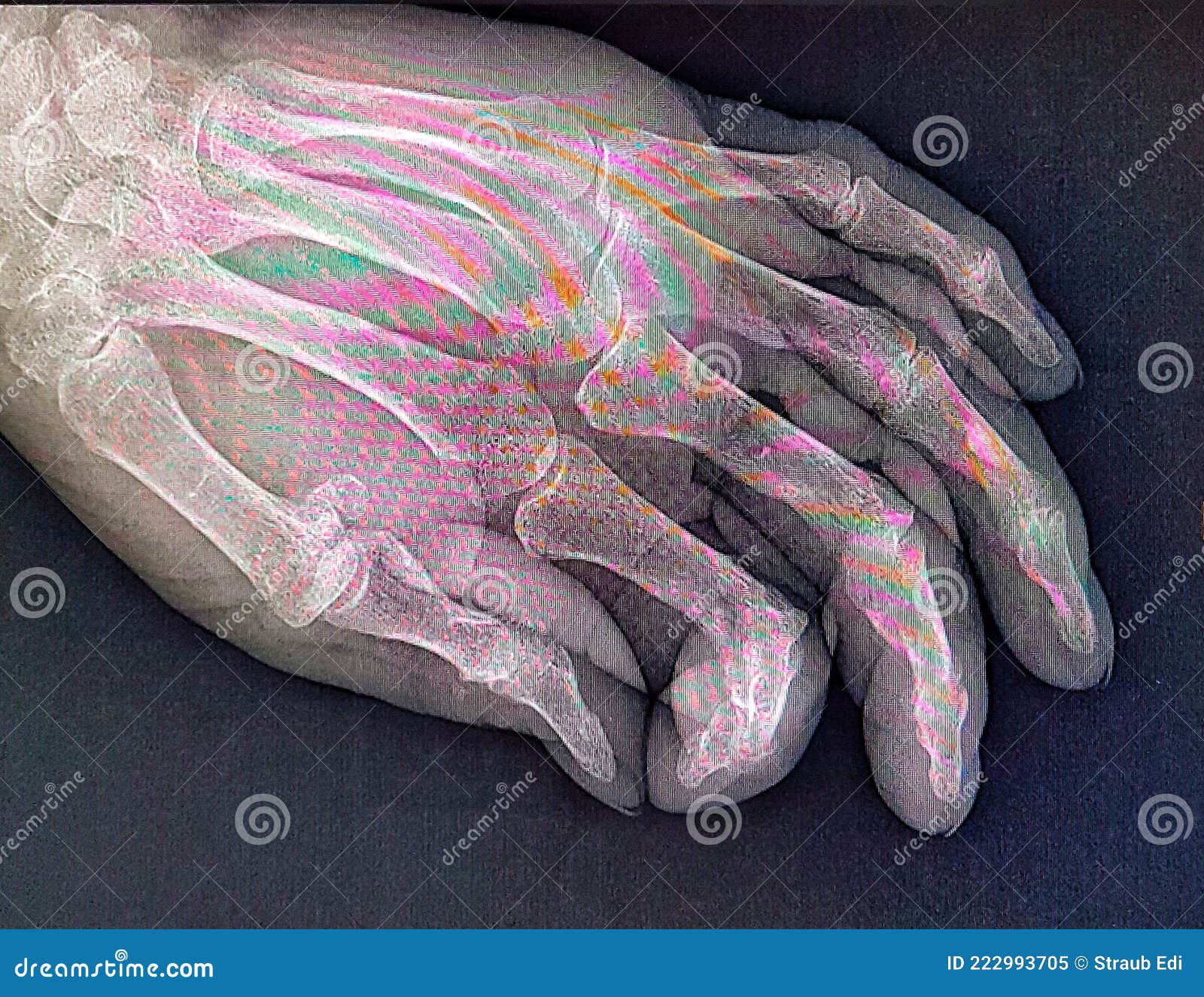 Left Hand Color Radiography Stock Image - Image of hand, radiograph ...