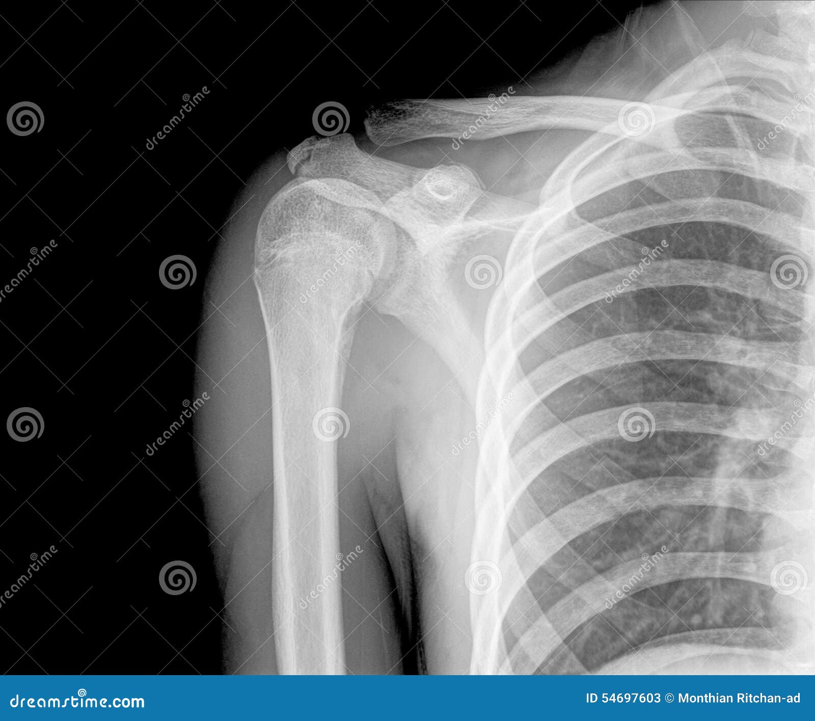 X-Ray stock image. Image of xray, anatomy, desease, doctor - 54697603