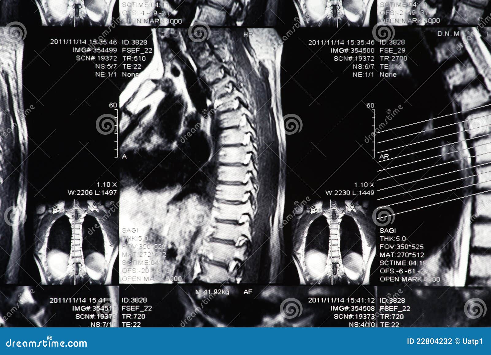 X-ray photograph stock photo. Image of radiogram, technical - 22804232