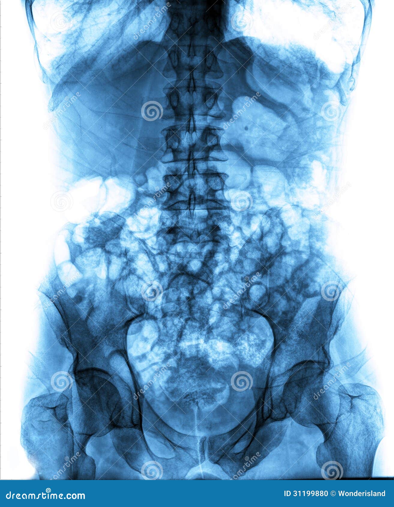 X-ray stock photo. Image of traumatology, skeleton, medicine - 31199880