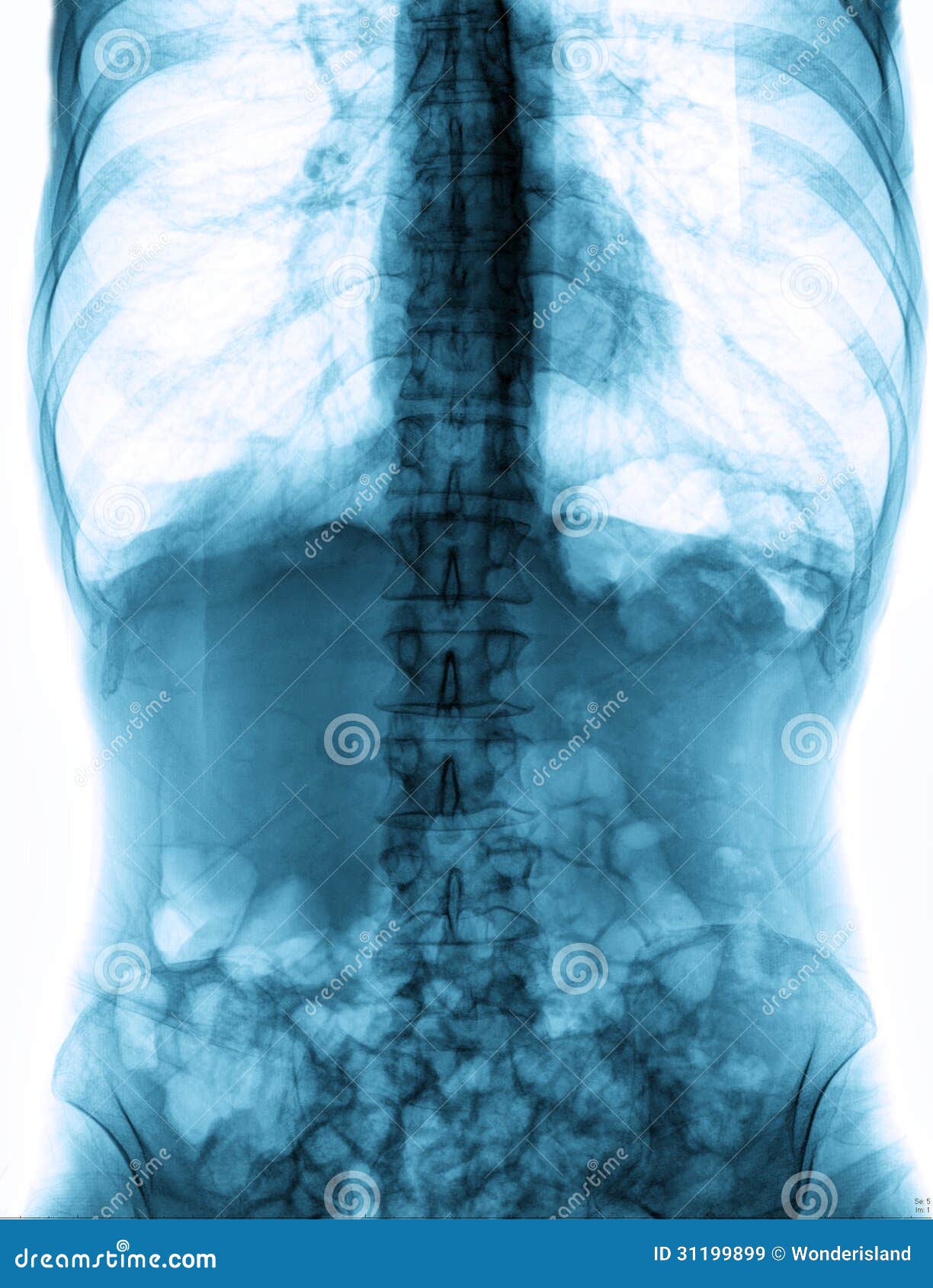 X-ray stock image. Image of injury, radiology, radiological - 31199899