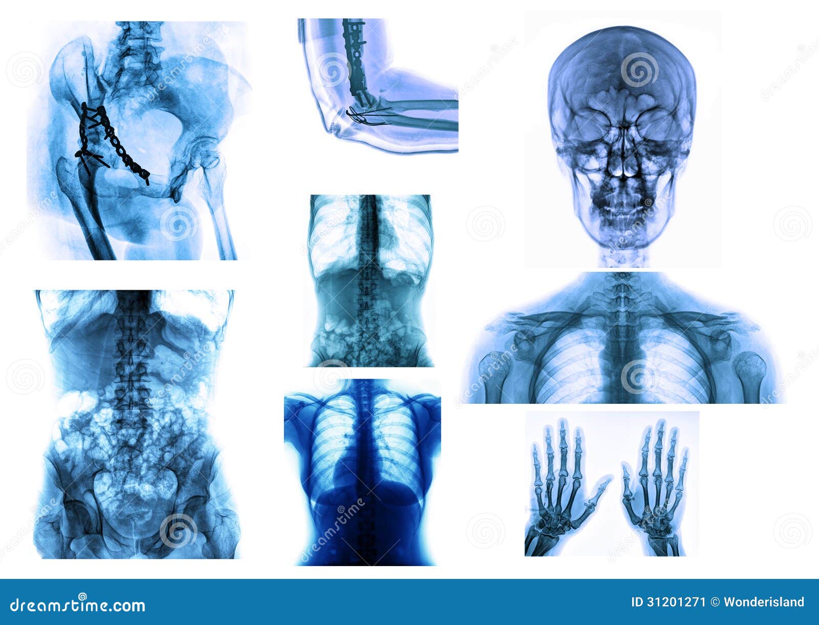 X-ray stock image. Image of report, hospital, joint, film - 31201271