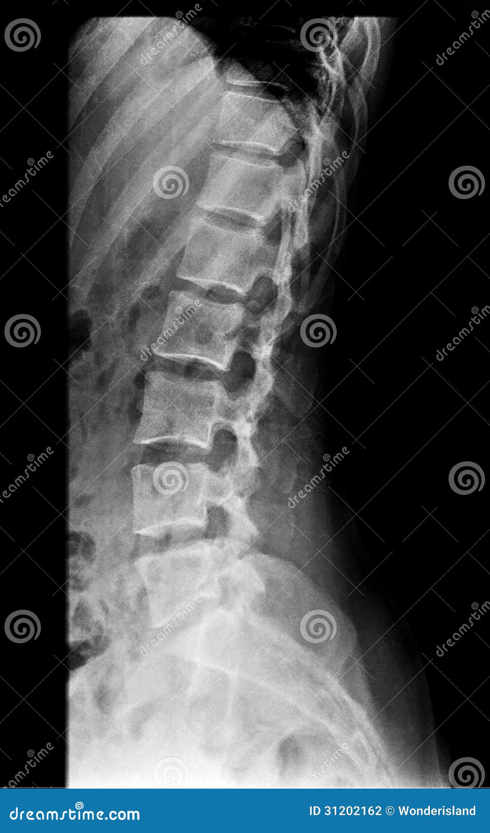 X-ray stock photo. Image of roentgen, healthcare, radiography - 31202162