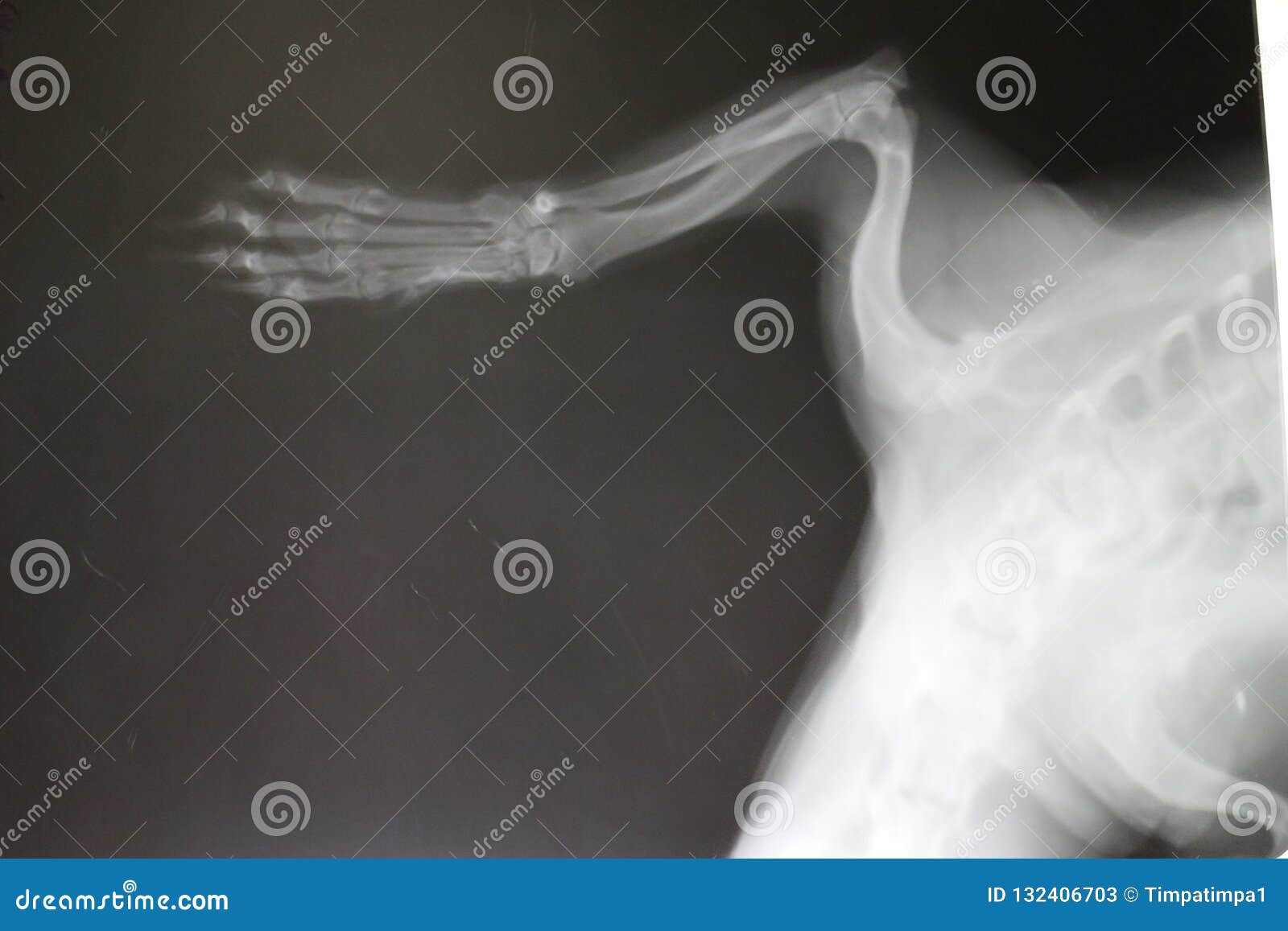 X-ray Picture of Forelimb by Dog Stock Image - Image of puppy, surgeon ...