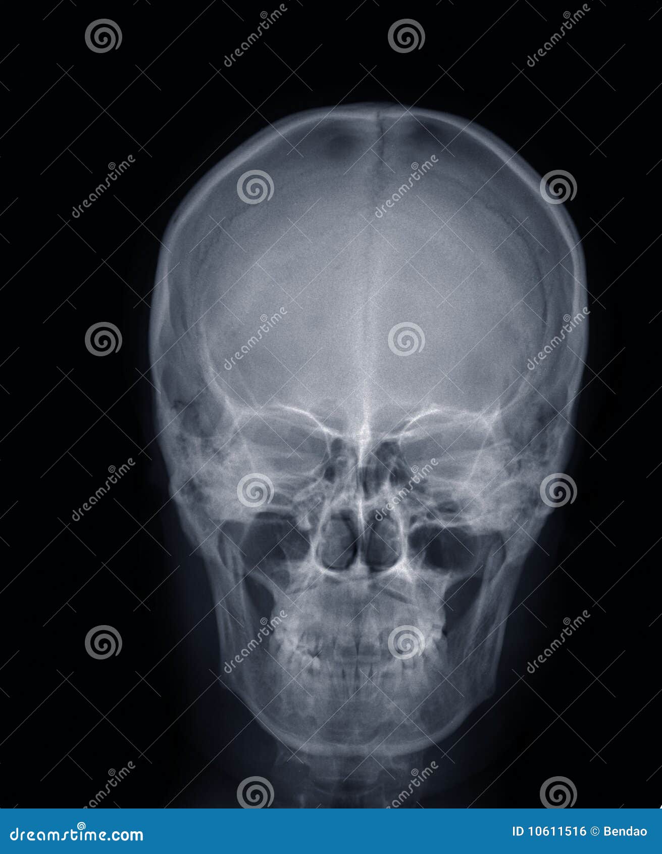 X Ray Head Front