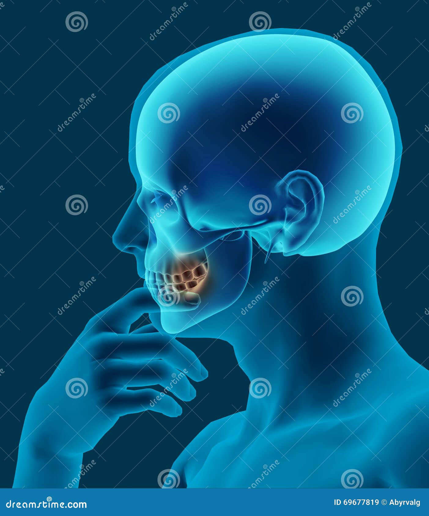 X-ray Picture of a Man with a Toothache Stock Illustration ...