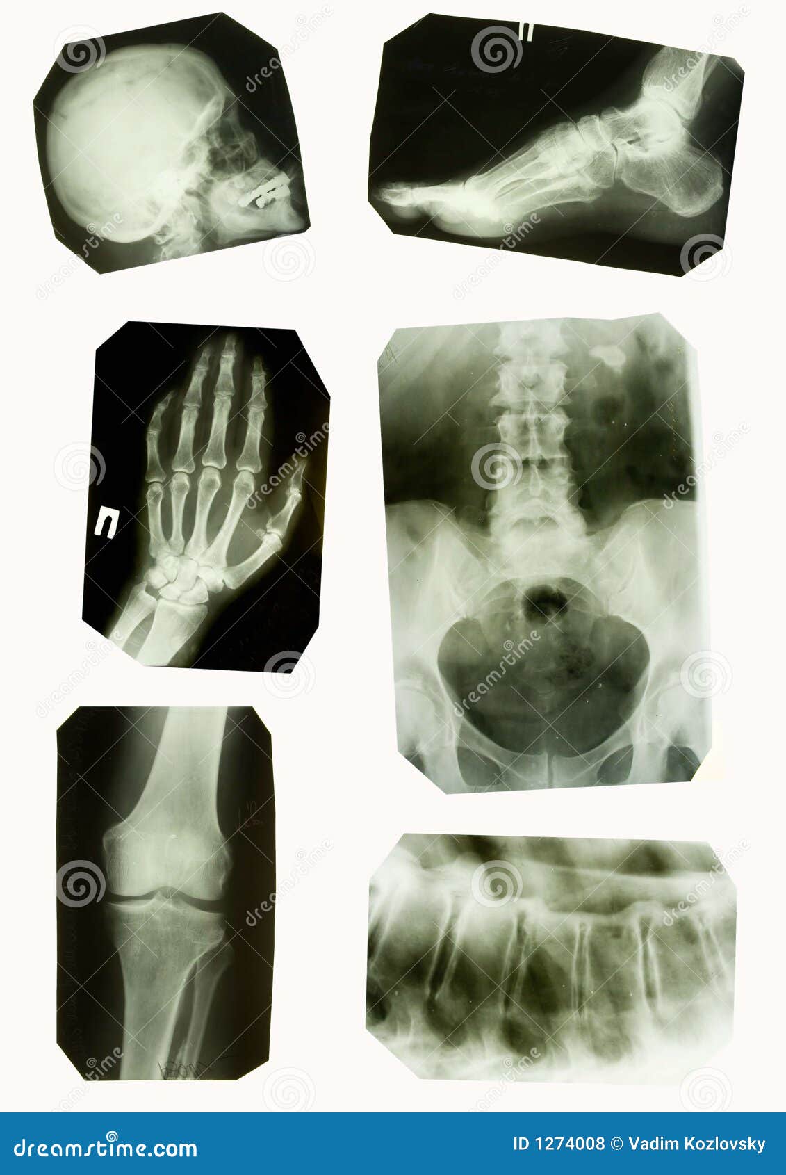 X-ray pictures stock photo. Image of clinic, orthopedic - 1274008