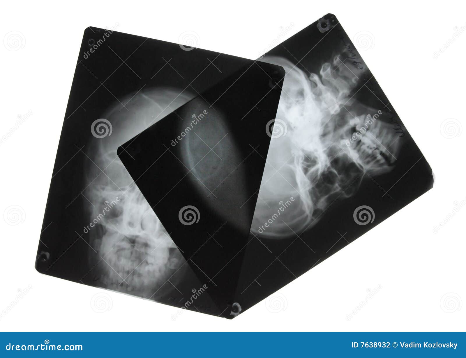 X-ray pictures stock photo. Image of isolate, mind, knowledge - 7638932