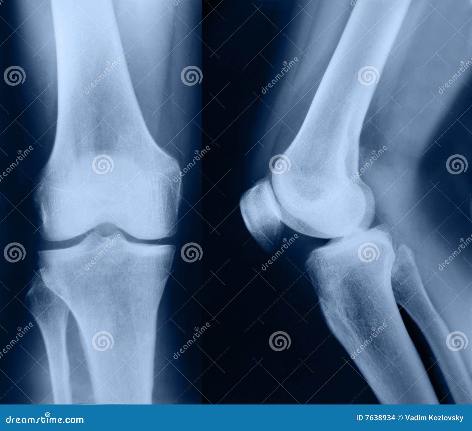 X-ray pictures stock photo. Image of reflect, science - 7638934