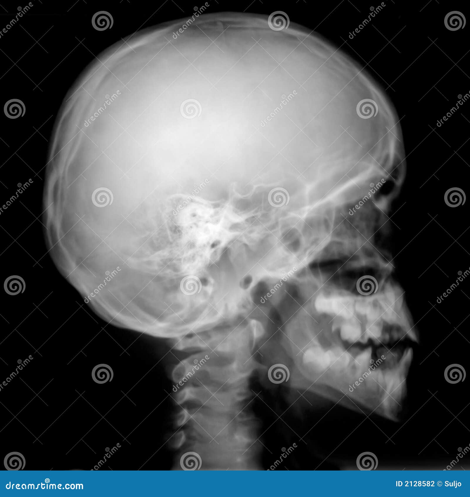X-Ray Profile stock photo. Image of medicine, medical - 2128582