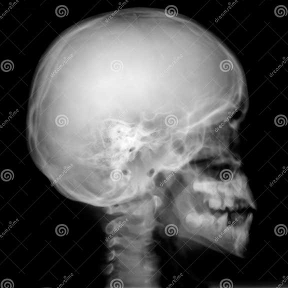 X-Ray Profile stock photo. Image of medicine, medical - 2128582