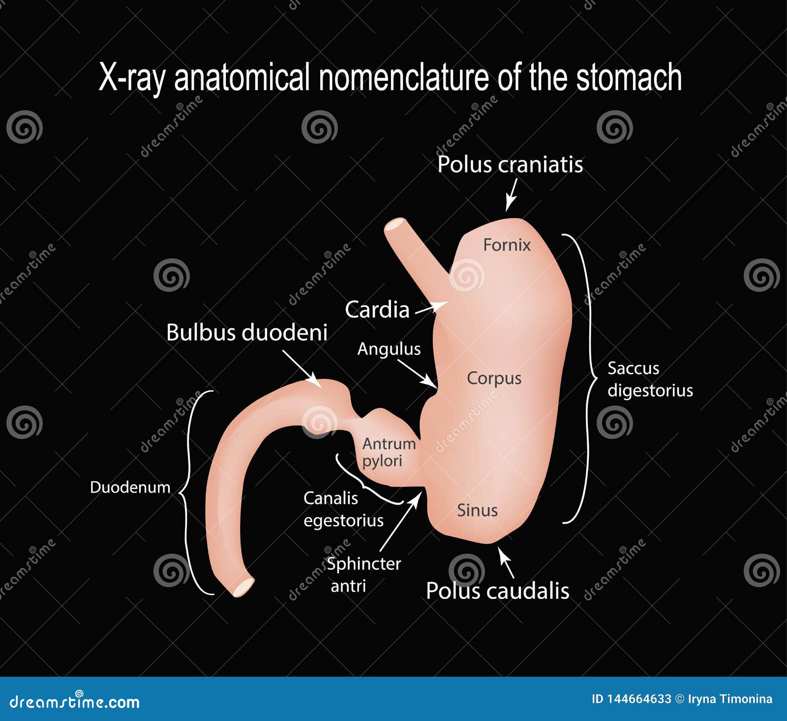 X-ray Range of the Stomach. Vector Illustration on a Black Background ...
