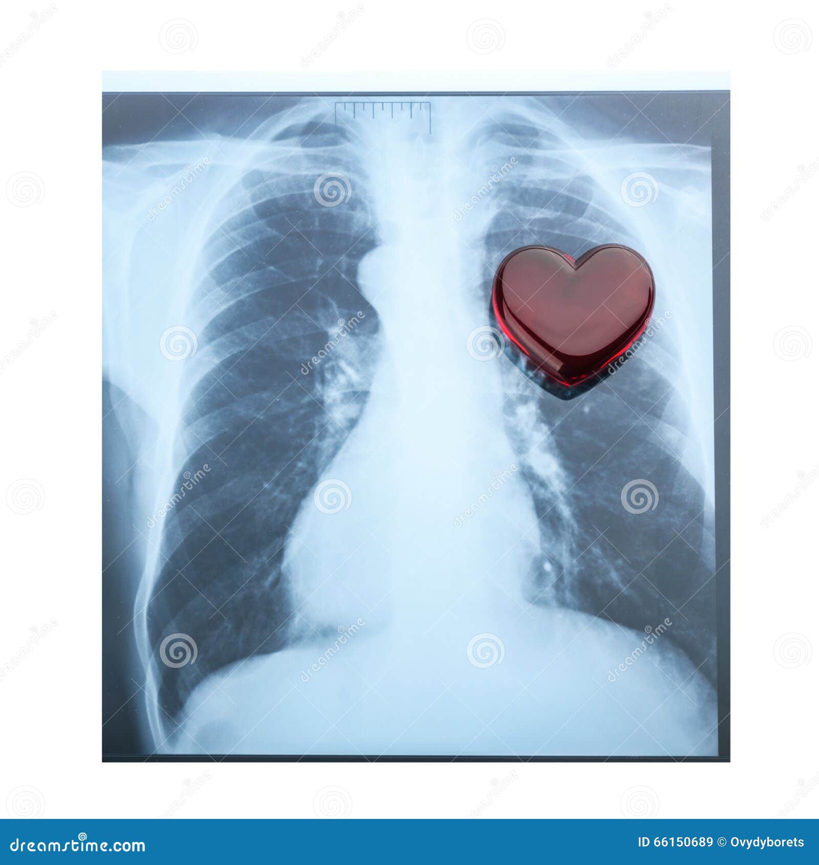X-ray Red Heart of Human on White Background. Stock Image - Image of ...