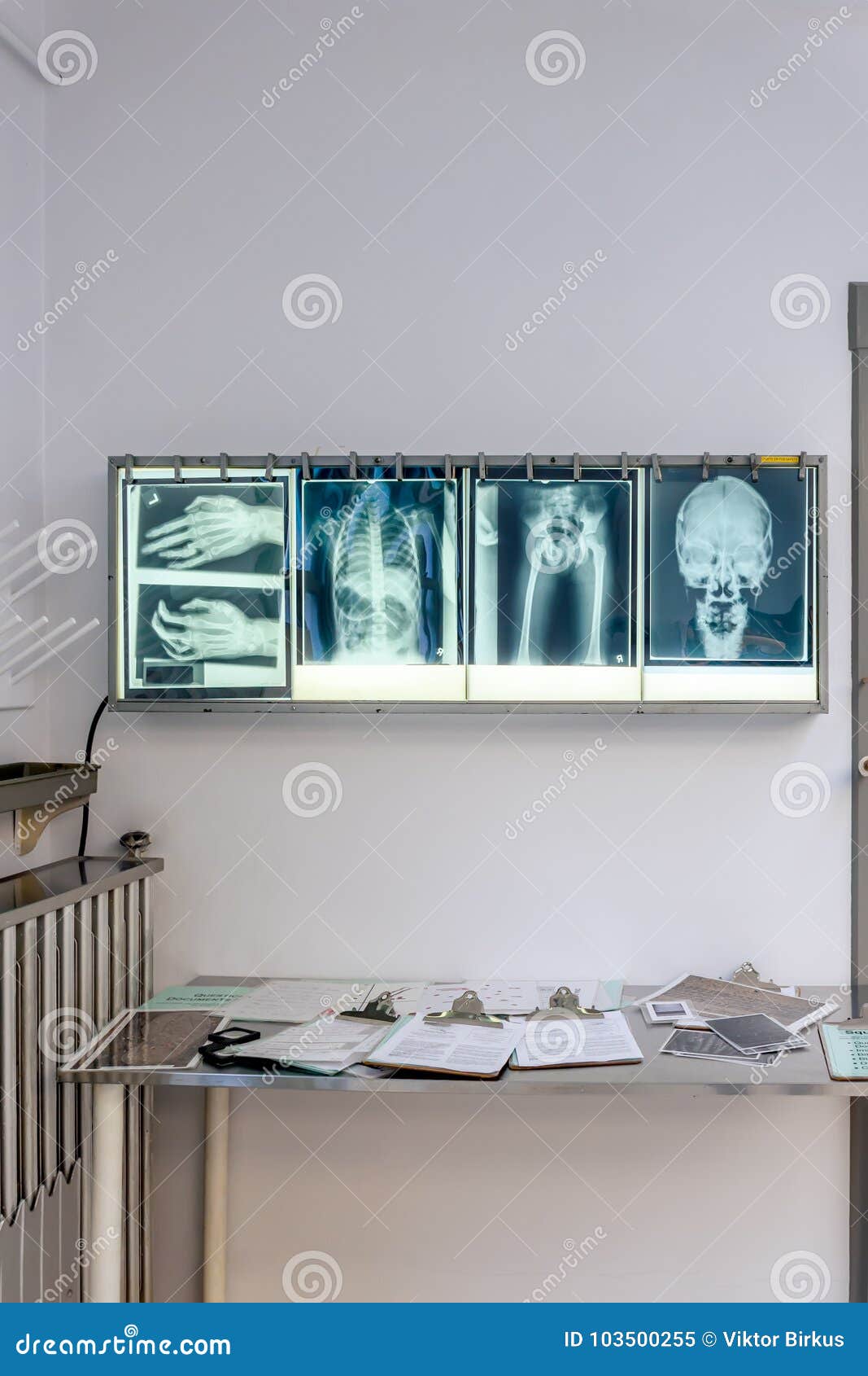 X-Ray result on the wall stock image. Image of result - 103500255