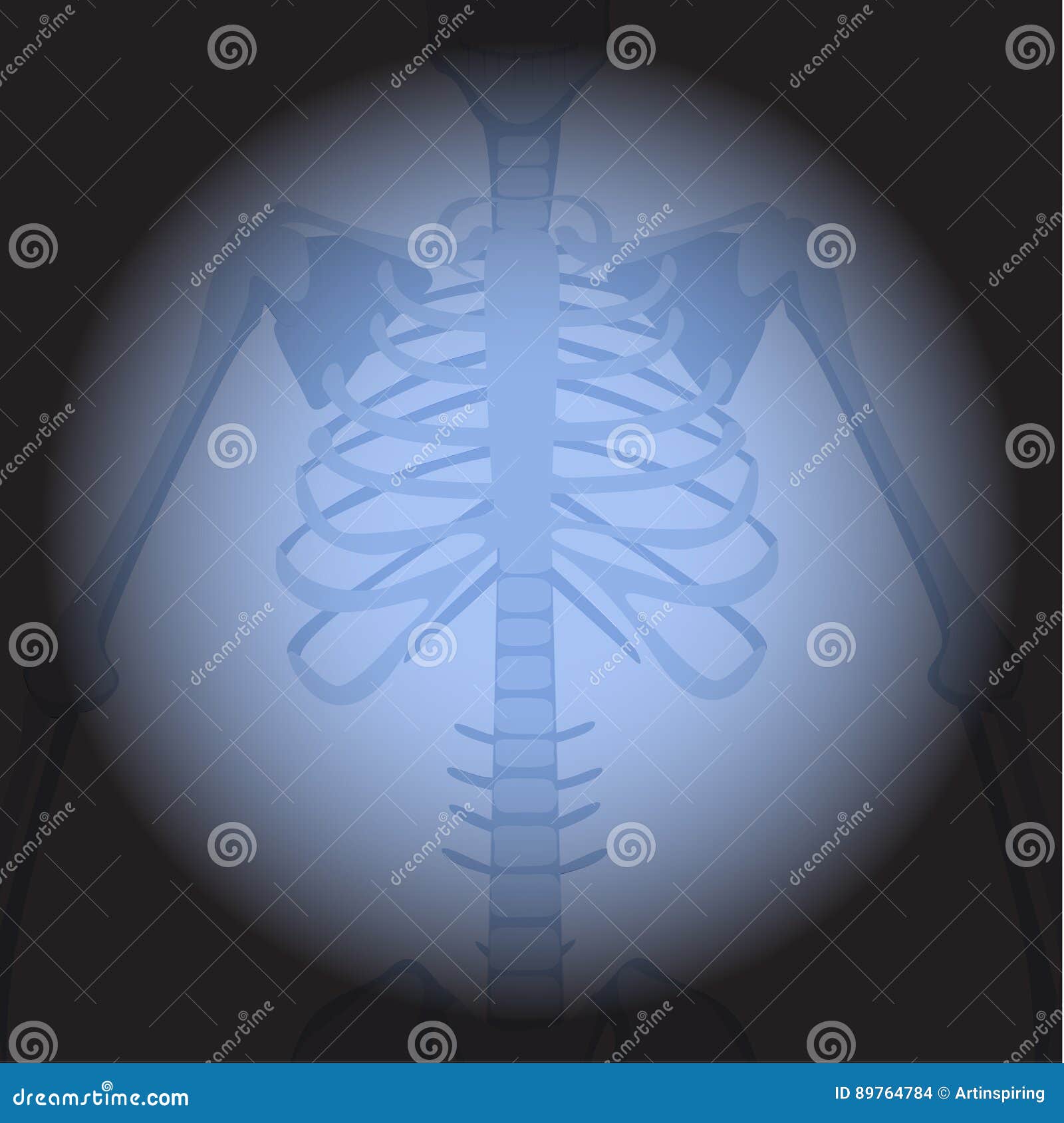 X ray ribs. stock vector. Illustration of concept, medical - 89764784