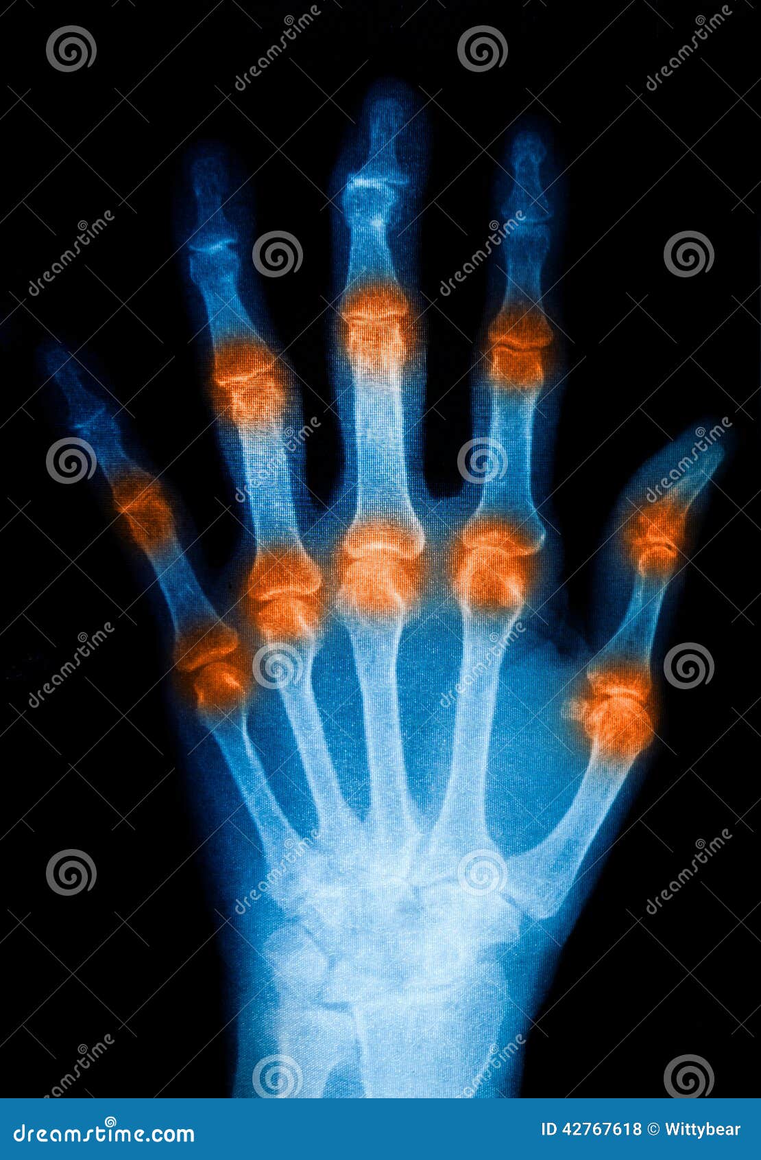 X-Ray scan human for hand stock photo. Image of anatomy - 42767618