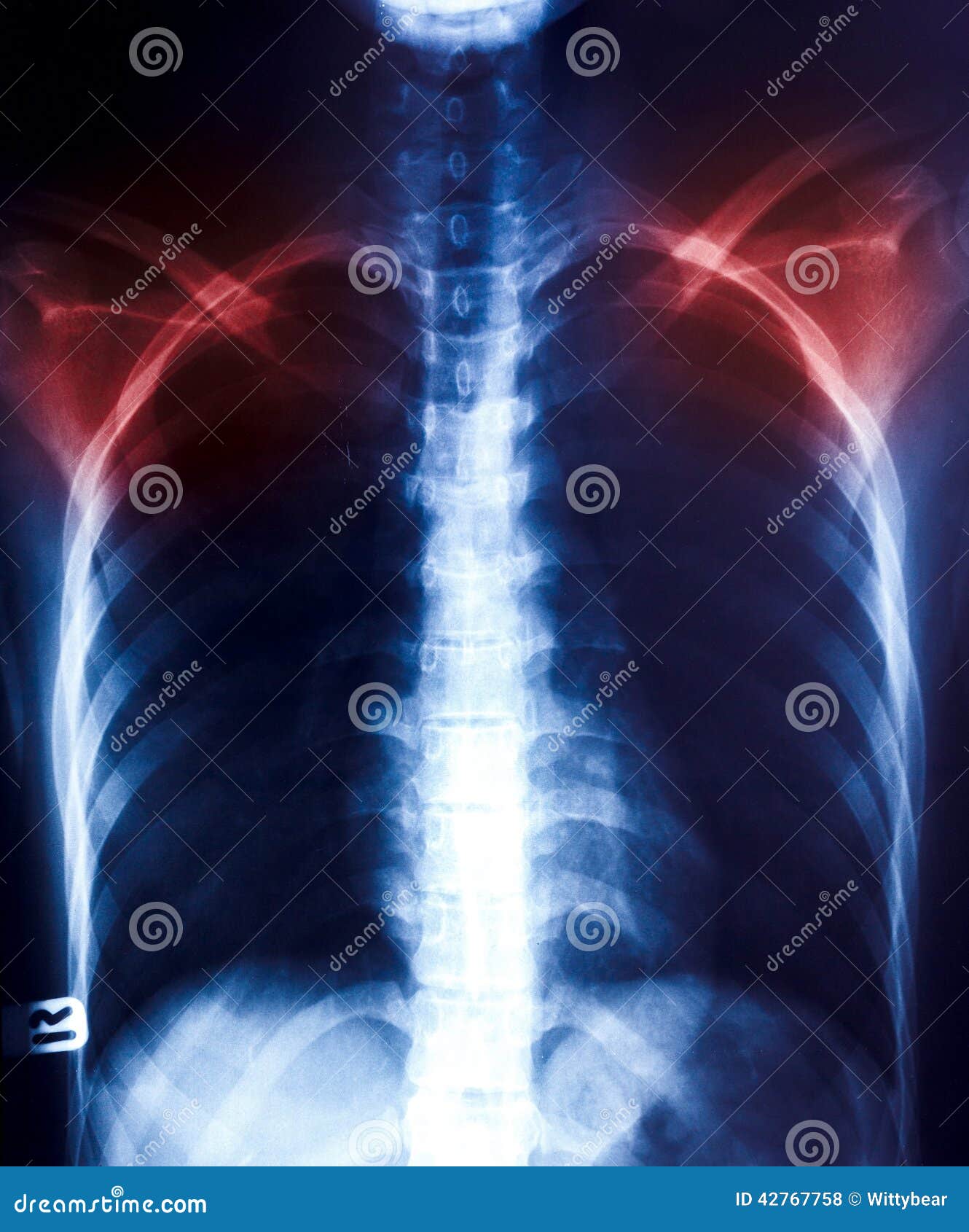 X-Ray scan human stock photo. Image of medical, film - 42767758