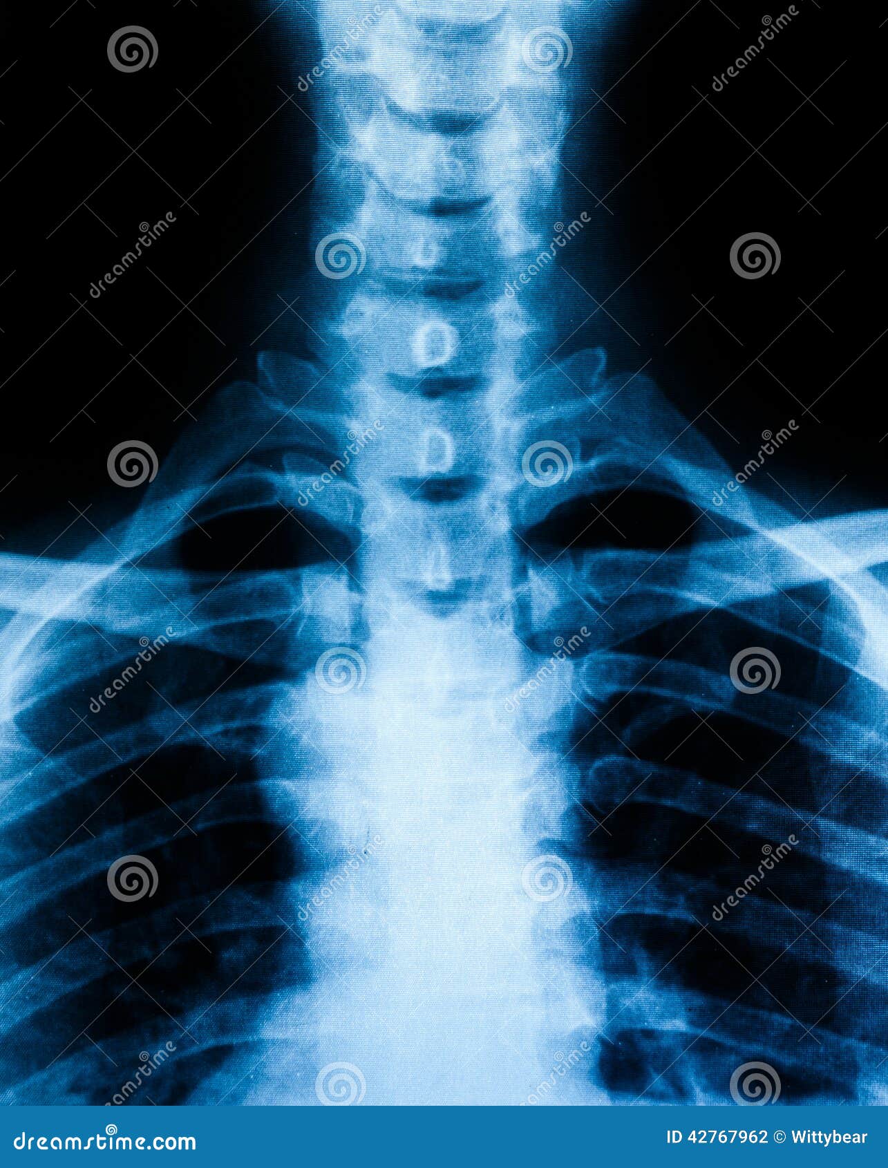 X-Ray scan human stock photo. Image of body, scan, anatomy - 42767962