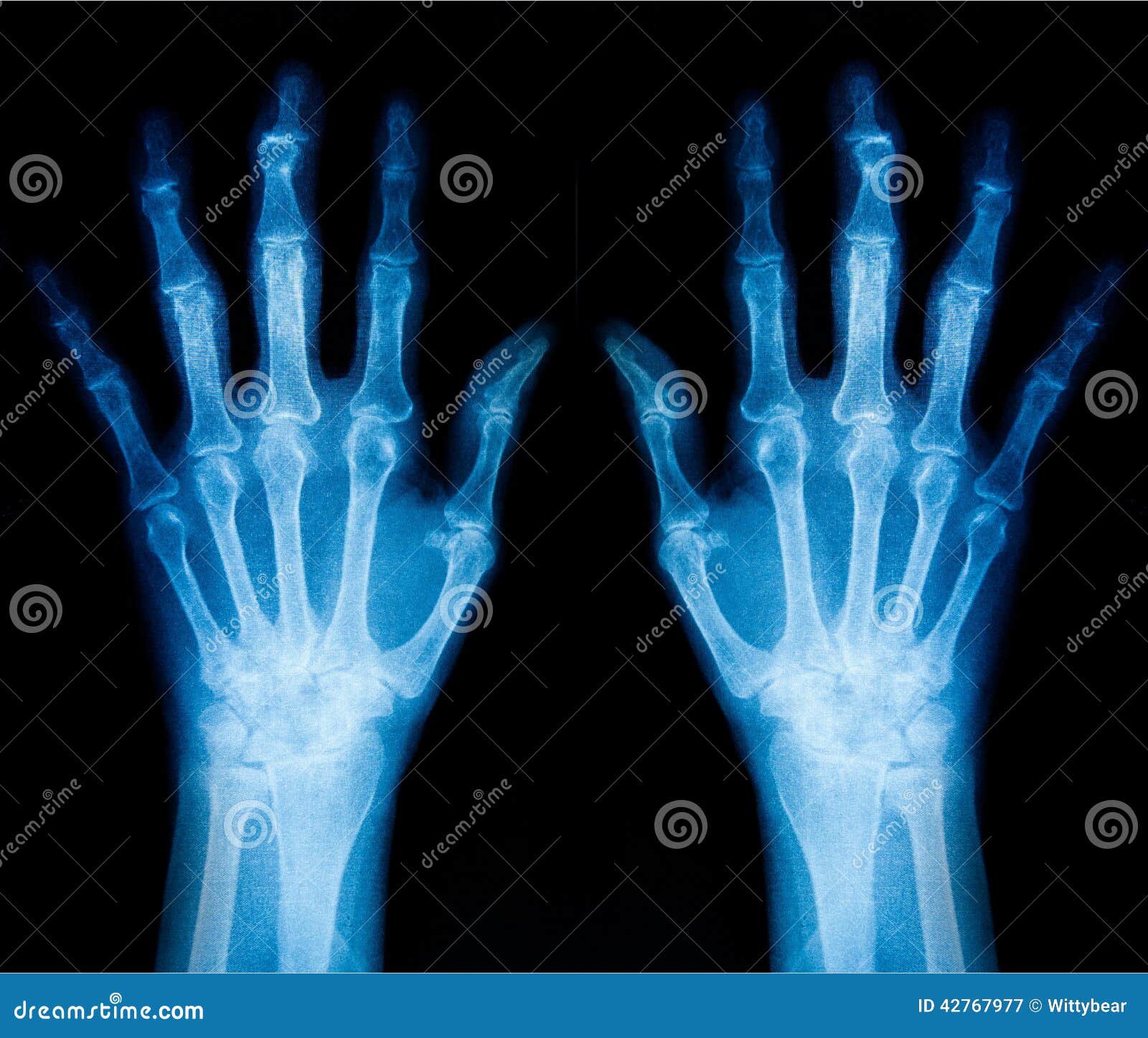 X-Ray scan human stock image. Image of film, medical - 42767977