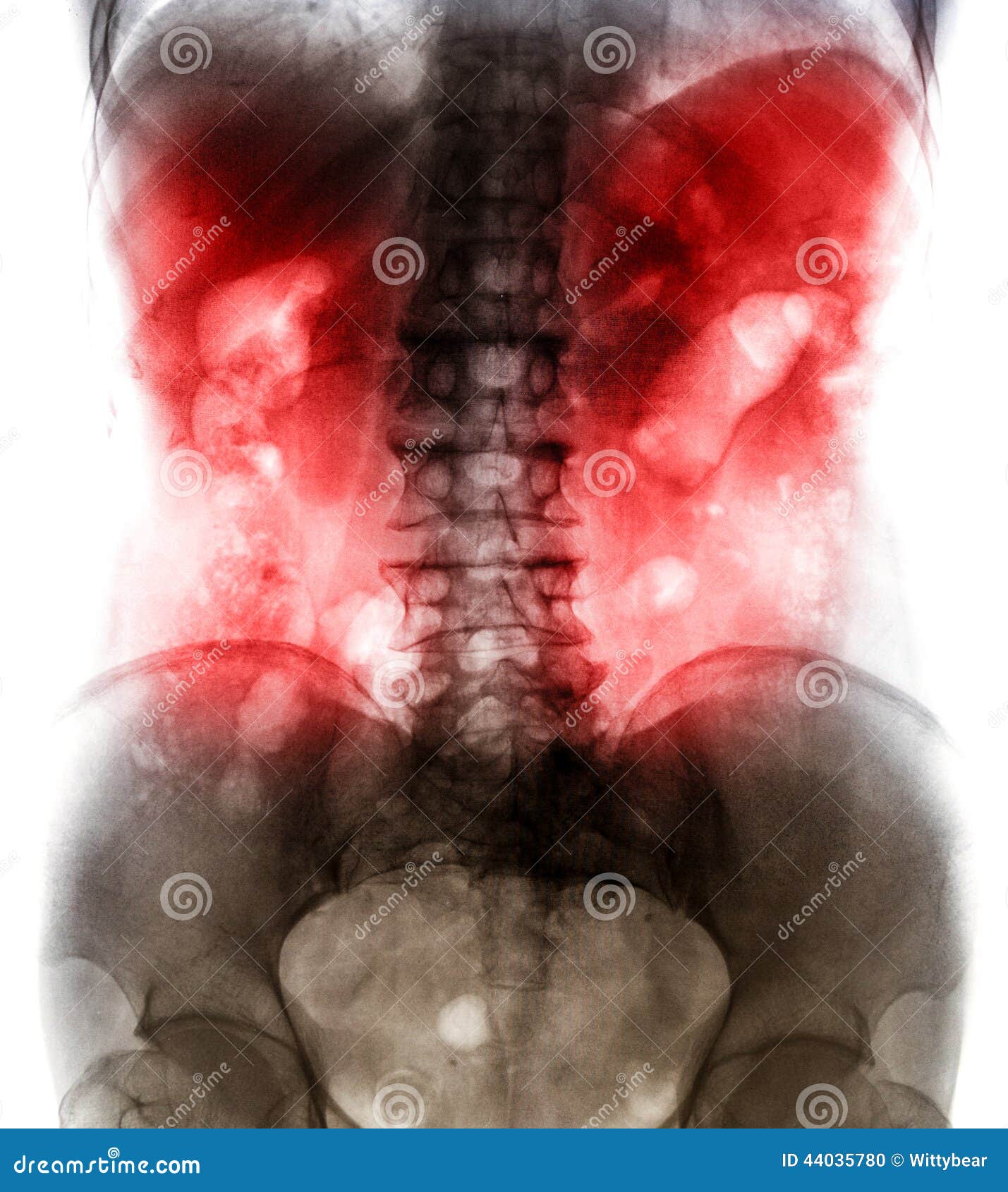 X-Ray scan human stock photo. Image of body, head, organ - 44035780