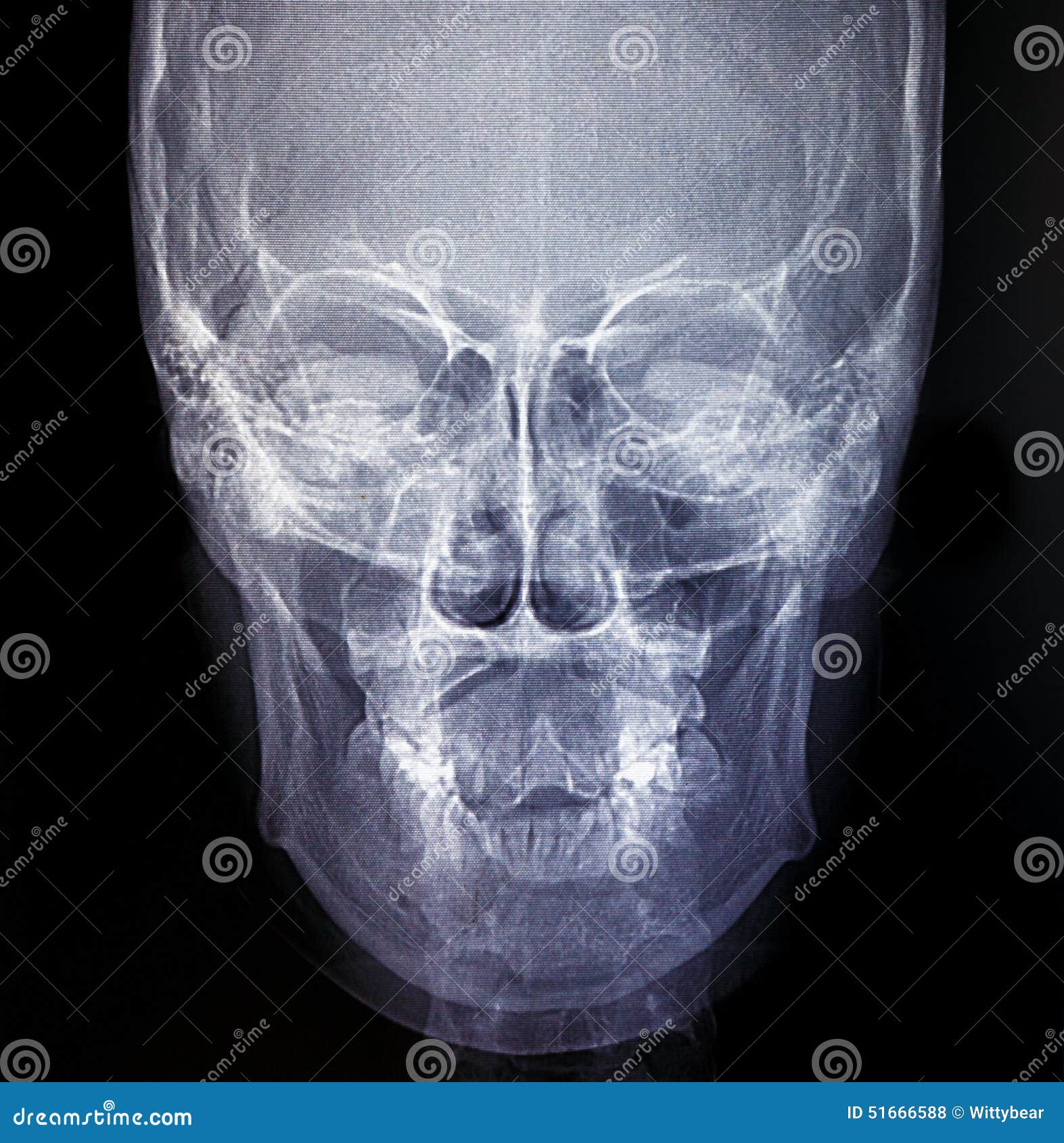 X-Ray scan human stock photo. Image of scan, bone, sick - 51666588