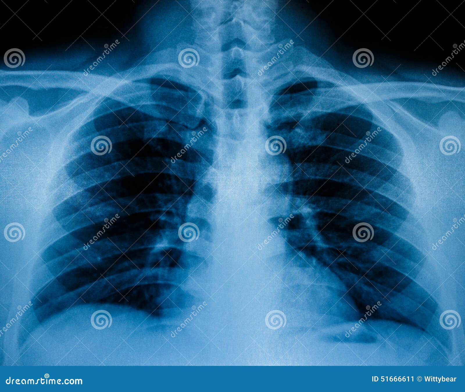 X-Ray scan human stock image. Image of skeleton, multiple - 51666611