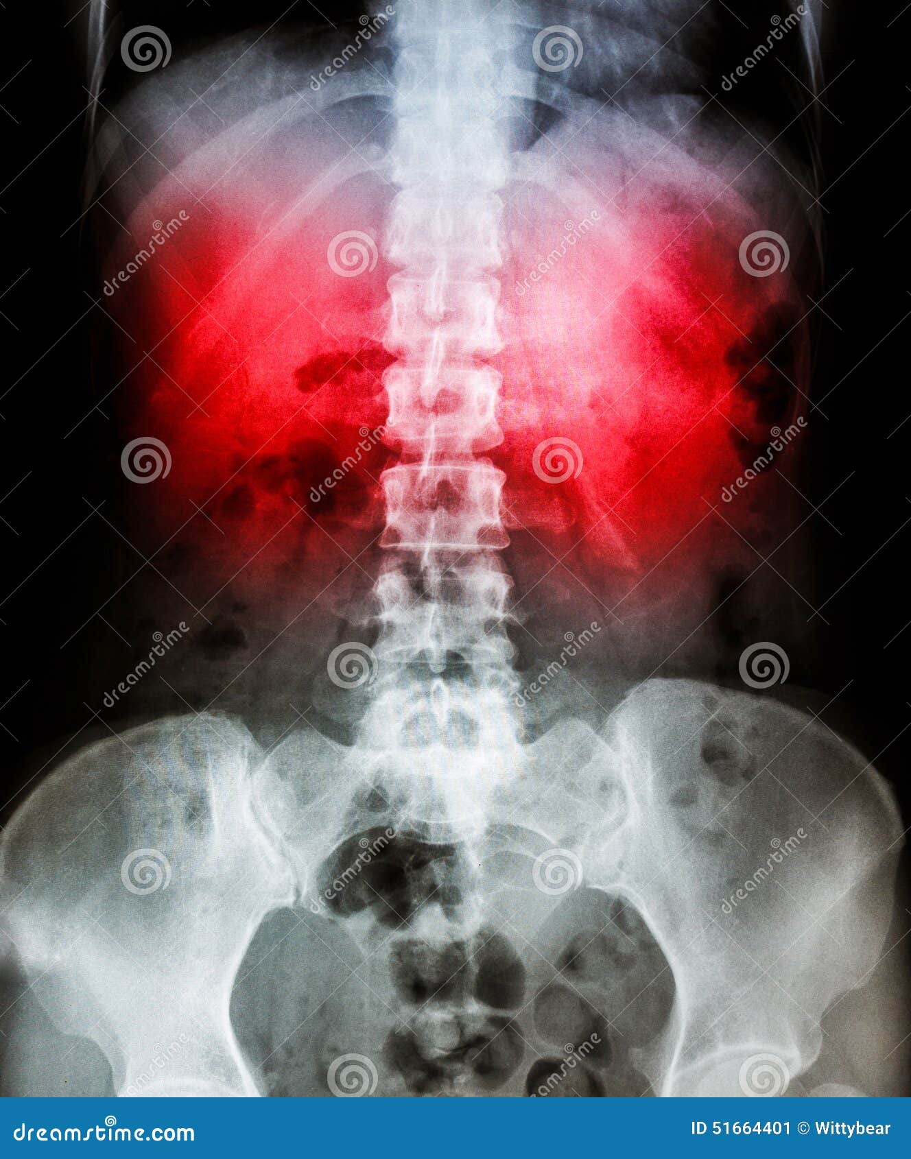 X-Ray scan human stock image. Image of body, orthopedic - 51664401
