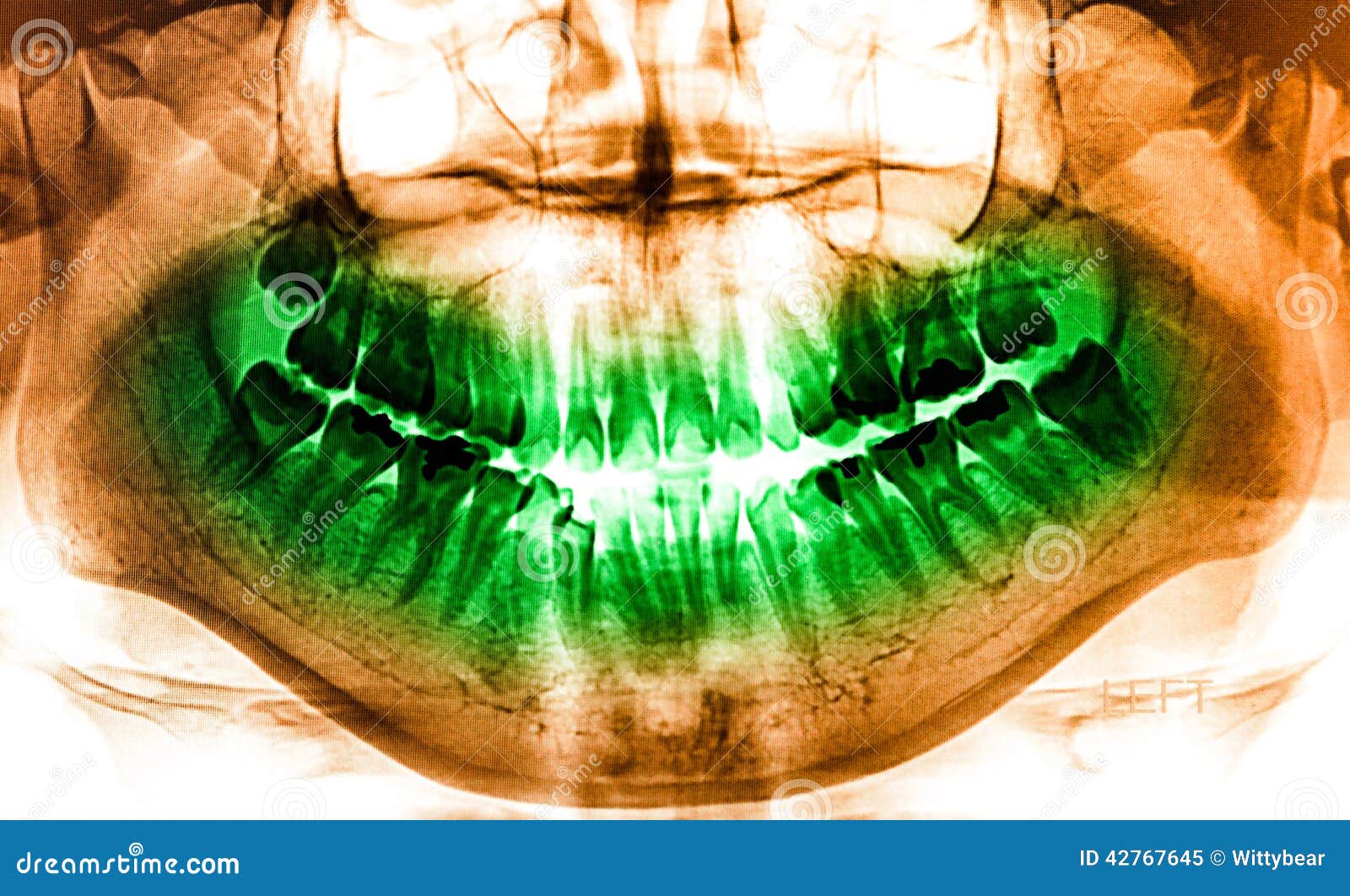 X-Ray Scan Human For Teeth Stock Image | CartoonDealer.com #42767731