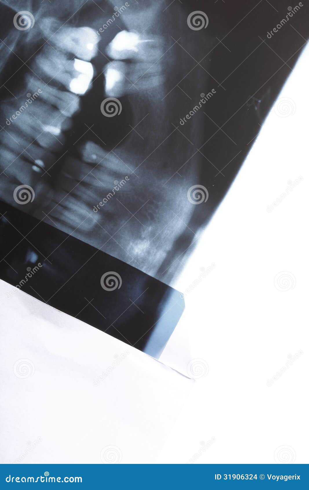X-ray scan of humans teeth stock photo. Image of root - 31906324