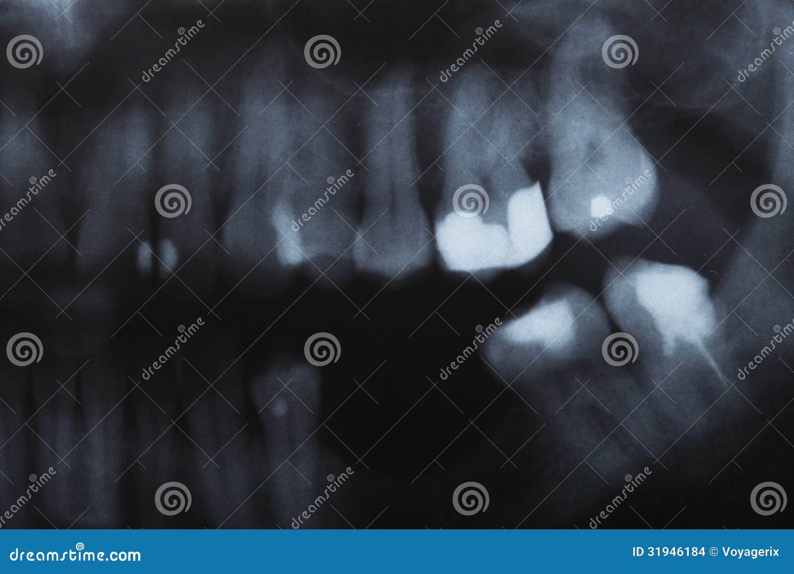 X-ray Scan Of Humans Teeth Stock Photo | CartoonDealer.com #30894924