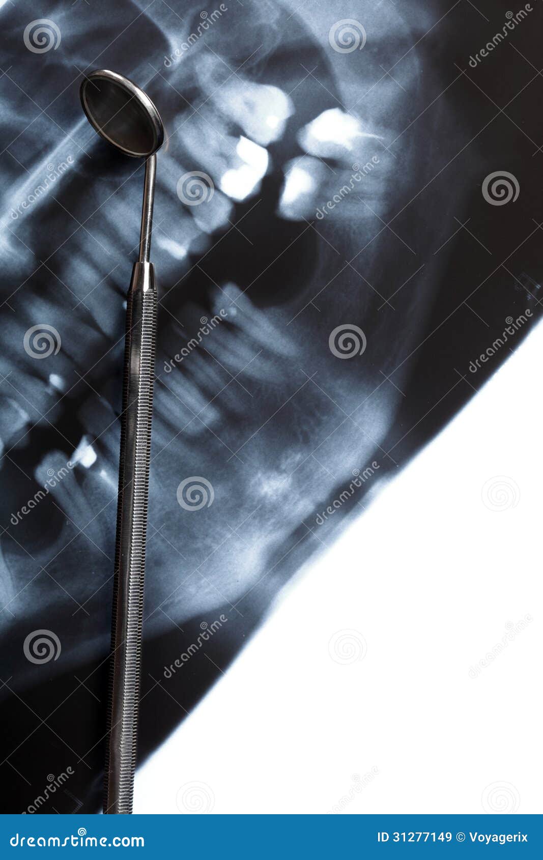 X-ray scan of humans teeth stock image. Image of diagnosis - 31277149