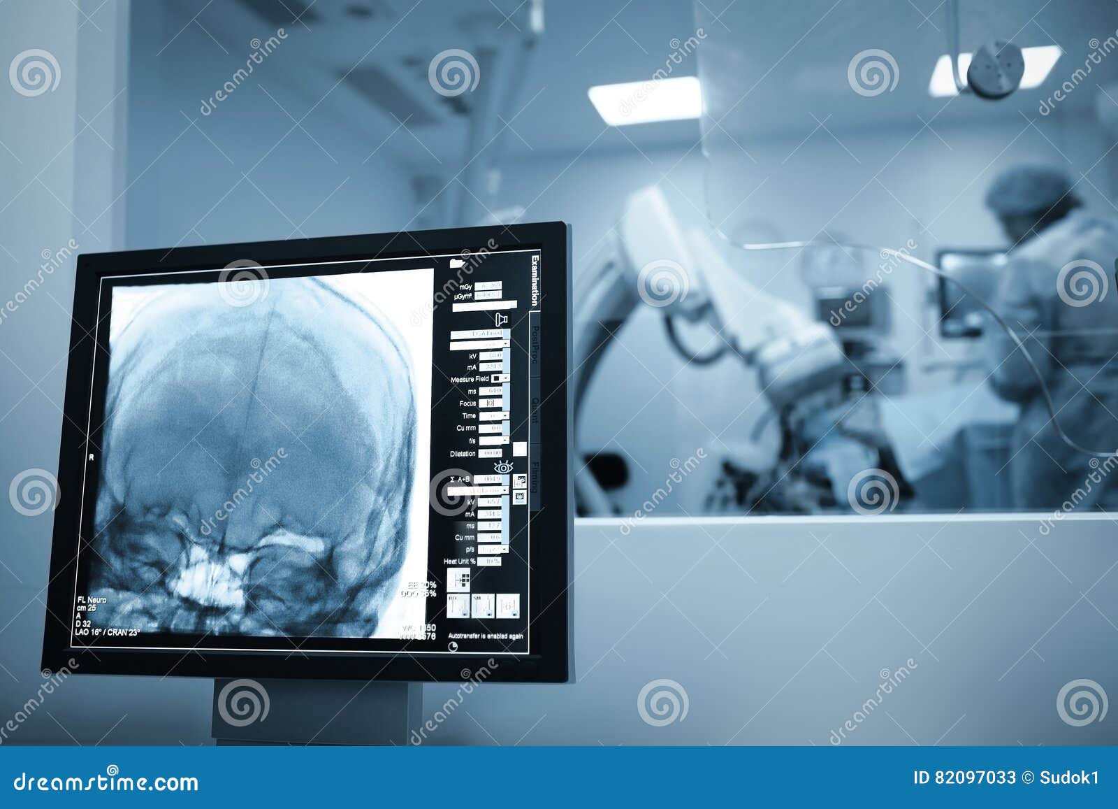 X-ray Scan of the Patients Brain during Surgery Stock Image - Image of ...