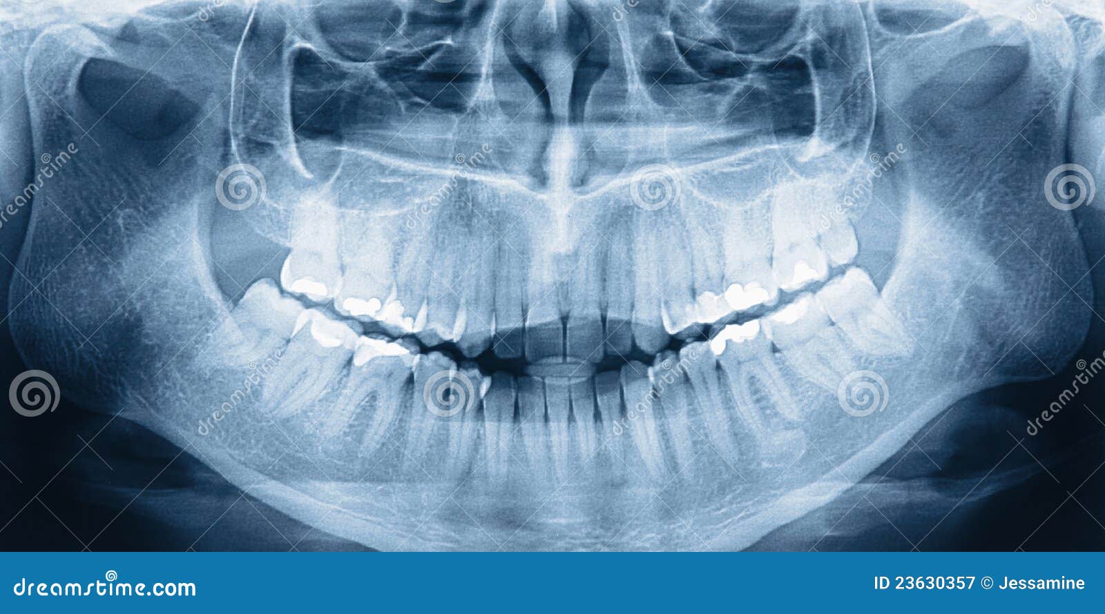 X-ray scan of teeth stock image. Image of human, care - 23630357