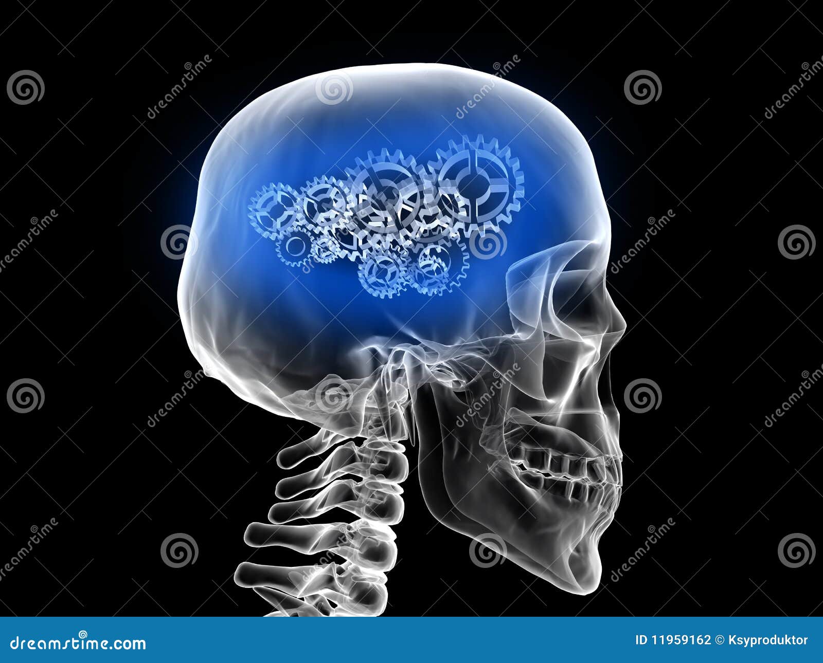 X-ray Schedel Met Toestellen - Het Denken Idee Stock Illustratie ...