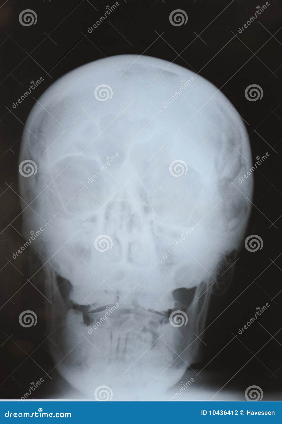 X-Ray shot stock photo. Image of medical, skull, skeleton - 10436412