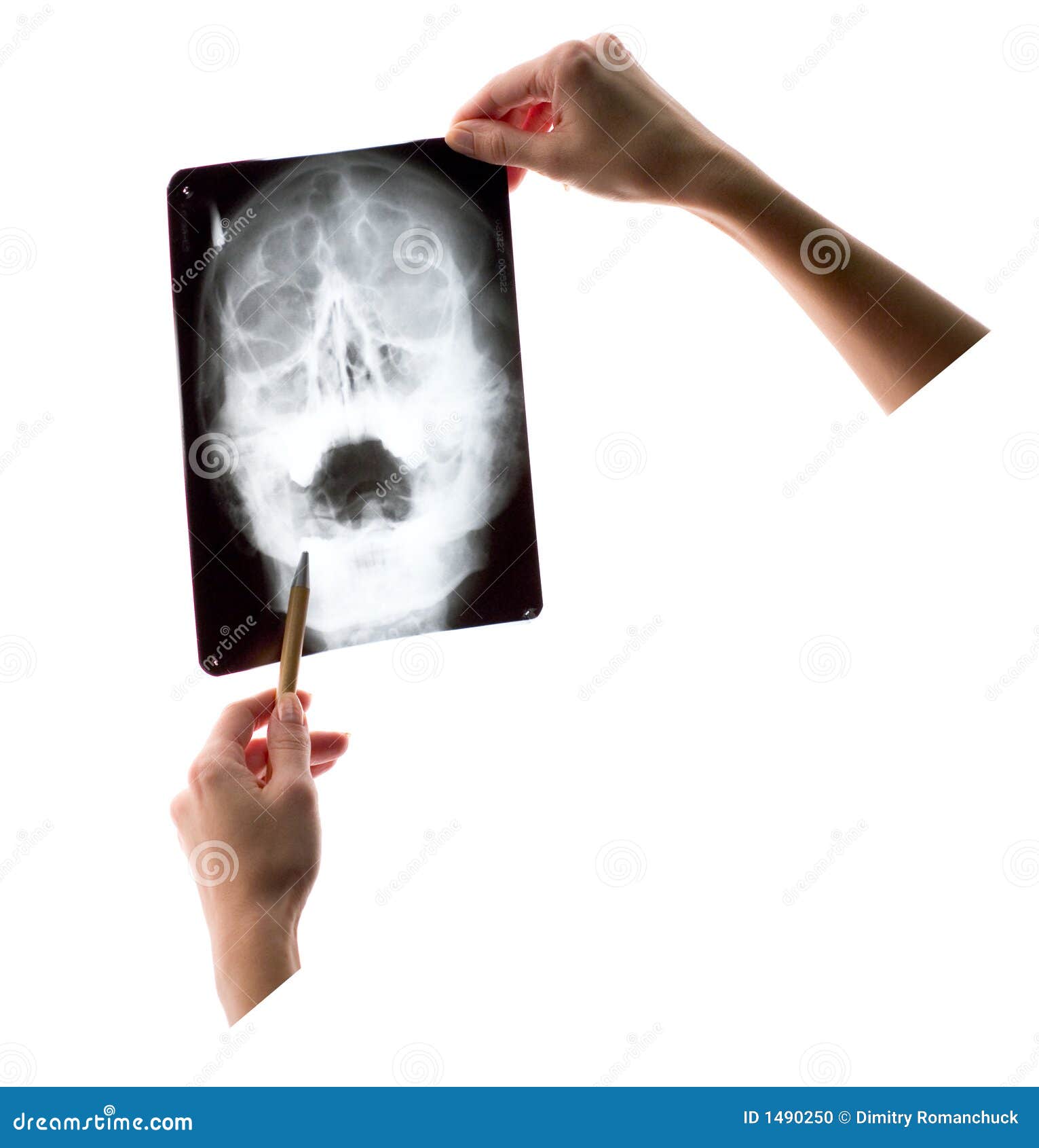 X-ray Shot Picture. Image: 1490250