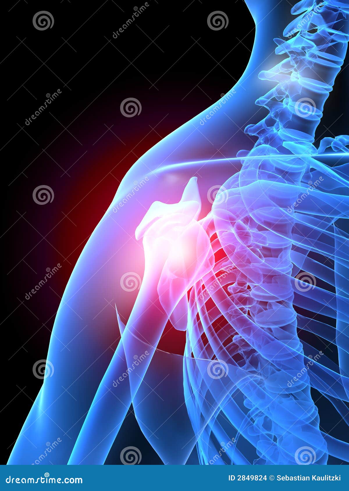X-ray Shoulder Stock Images - Image: 2849824