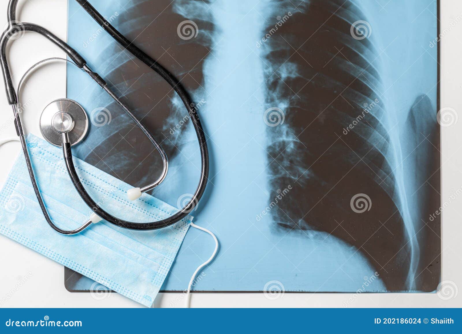 X-ray of Sick Lungs for Coronavirus, Mask and Stethoscope Stock Photo ...