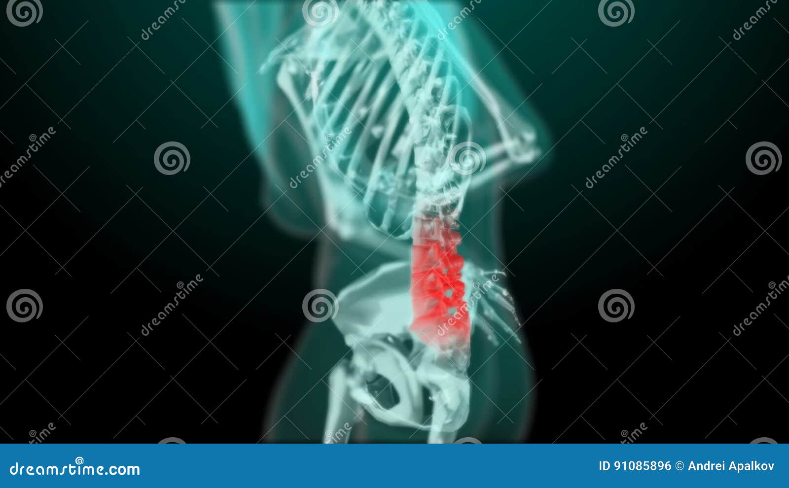 X-ray Skeleton Animation of Lower Back Spine Pain Stock Footage - Video ...