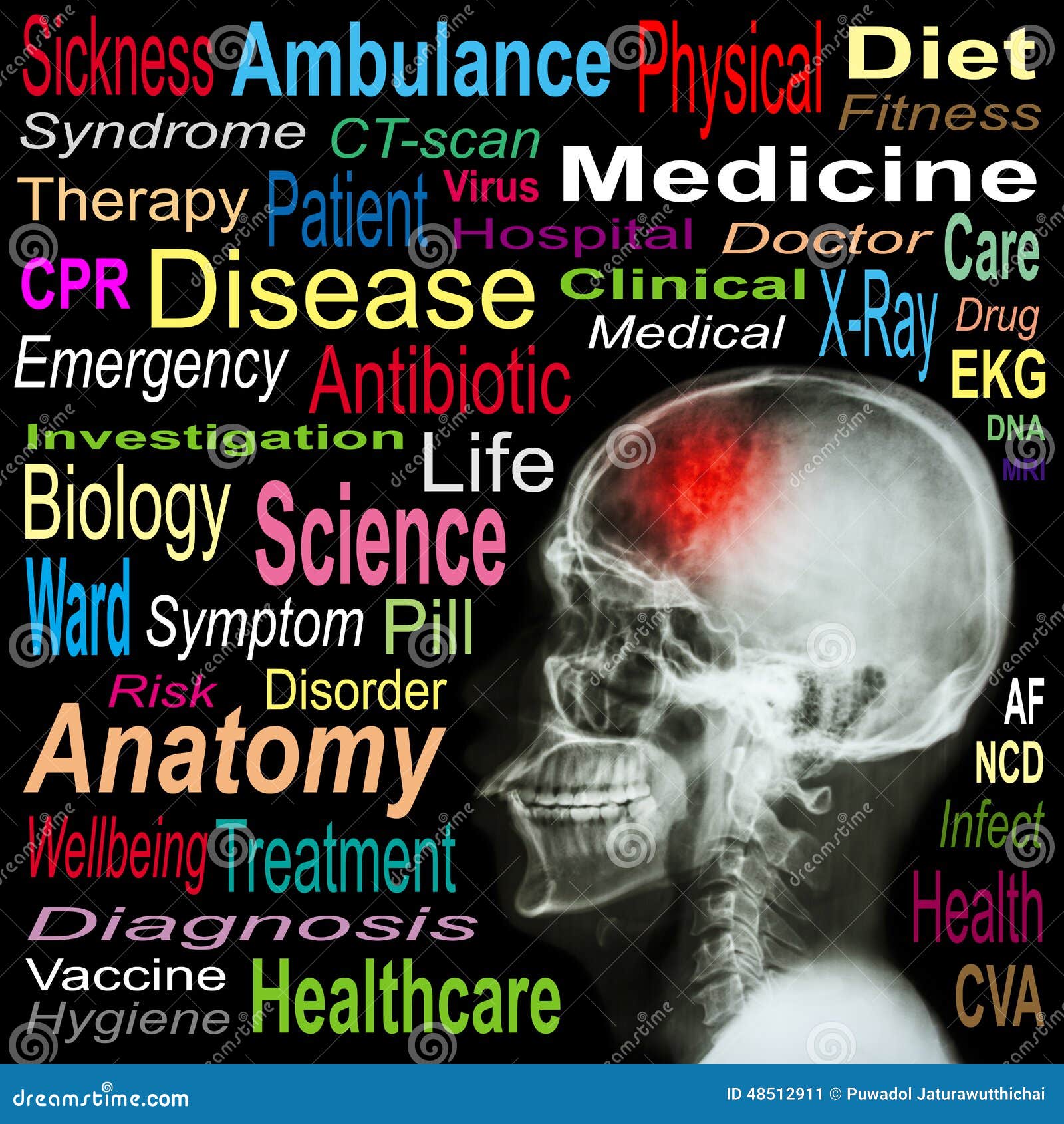 X-ray Skull and Stroke and Medical Word Cloud Stock Illustration ...