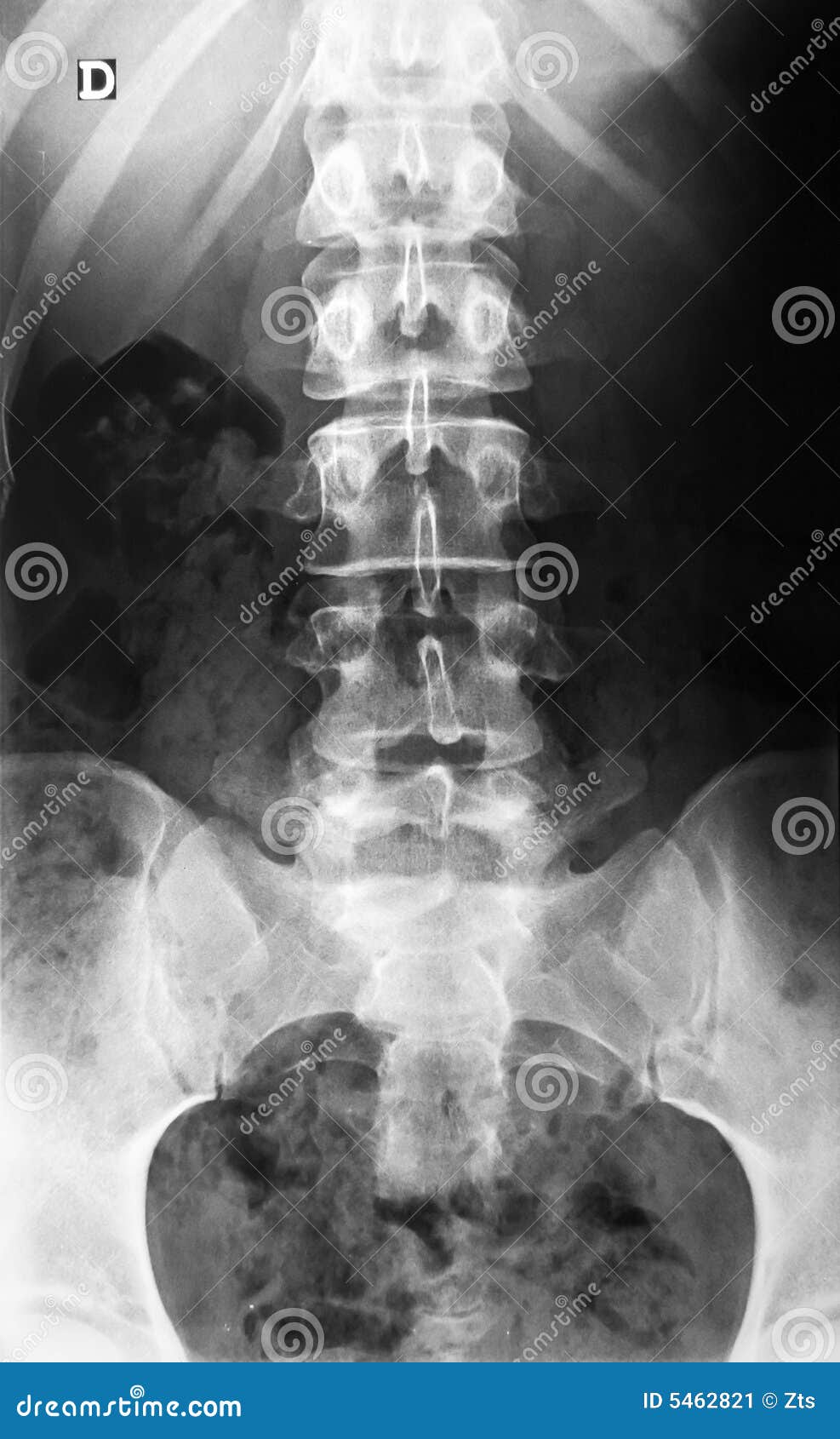 X-ray of the spinal column stock image. Image of body - 5462821
