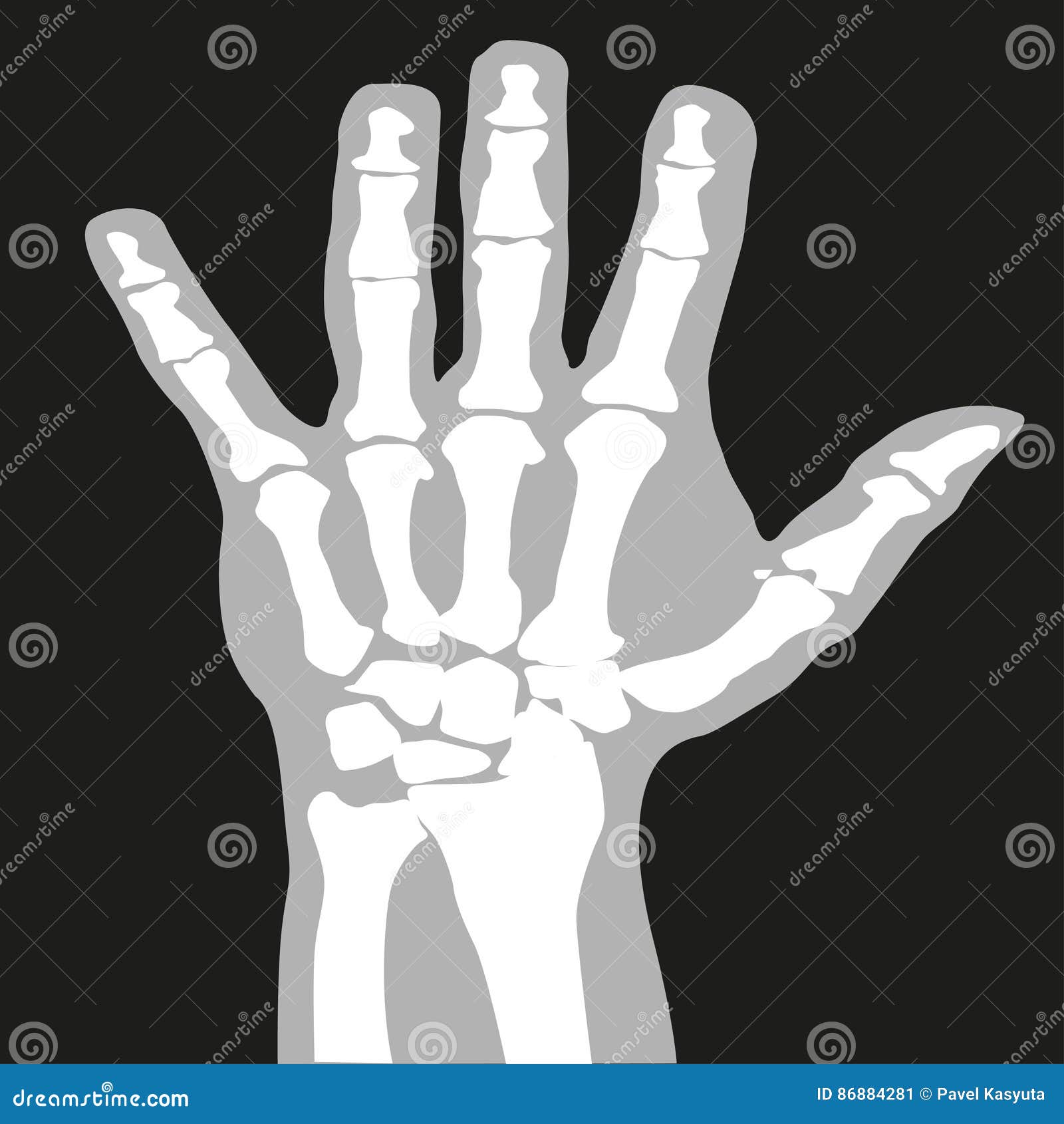 X-ray. Symbol. Vector Illustration. Stock Vector - Illustration of sick ...