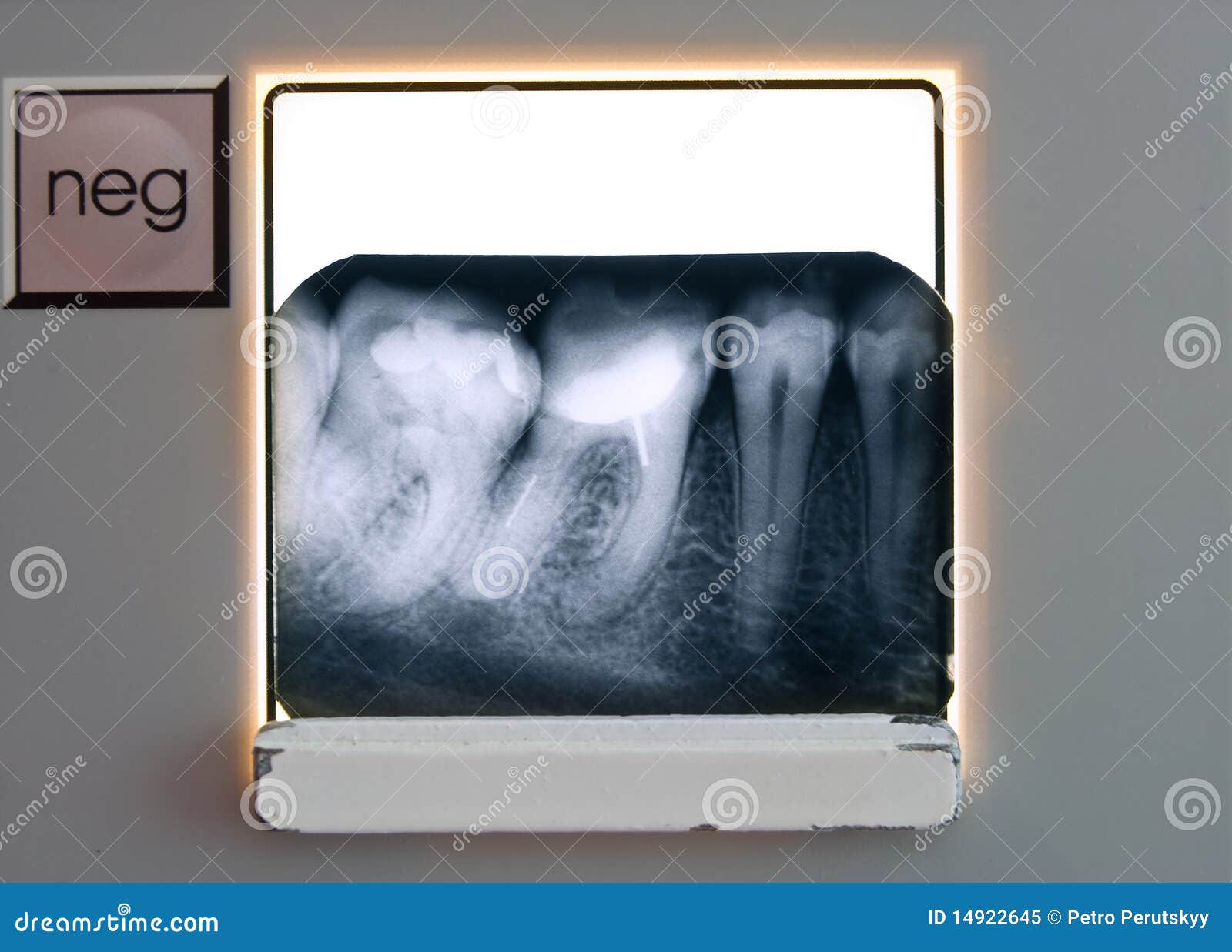 X-ray teeth diagnostics stock image. Image of retail - 14922645